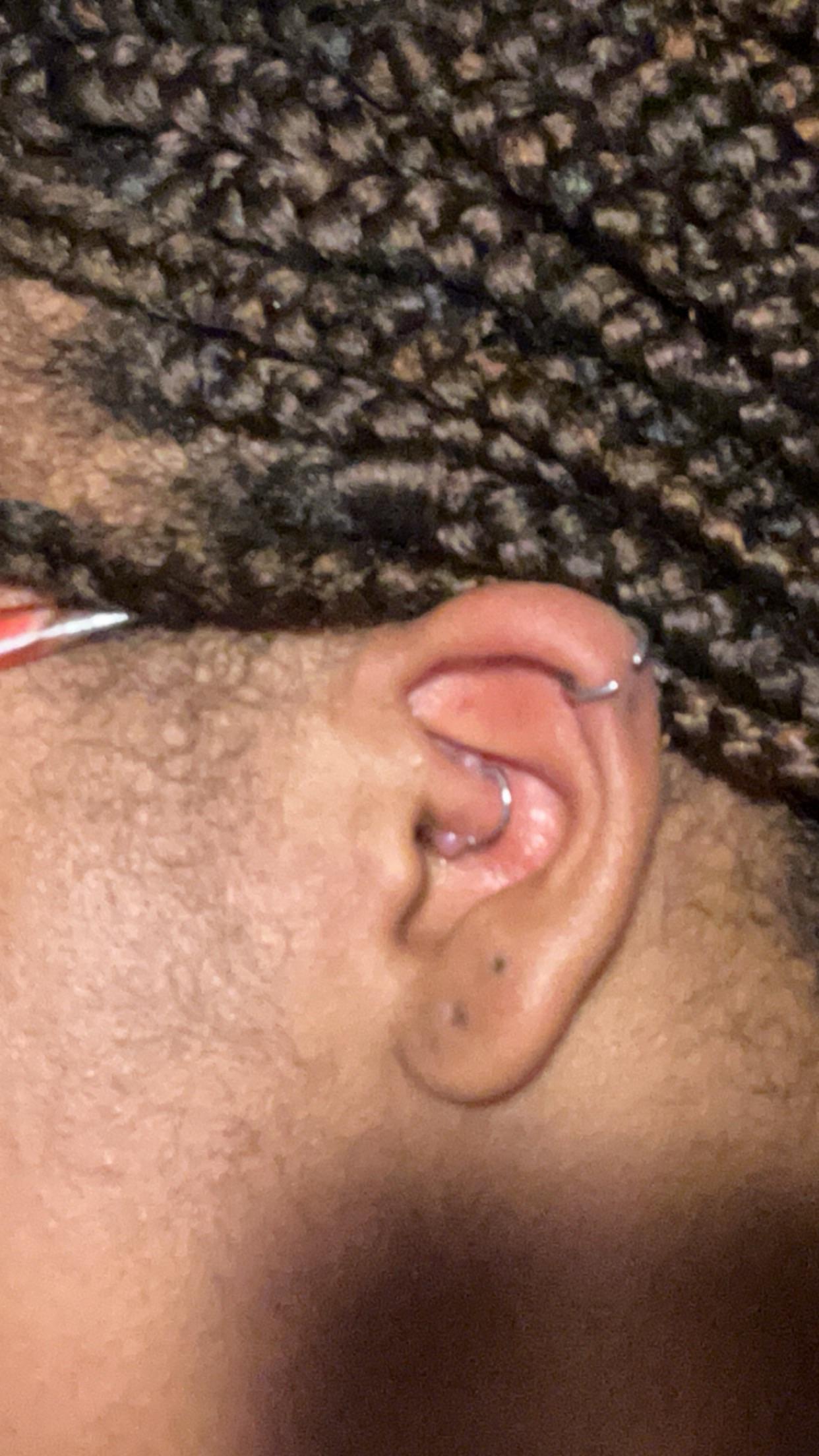 Help! Piercing bumps on my daith | Scrolller