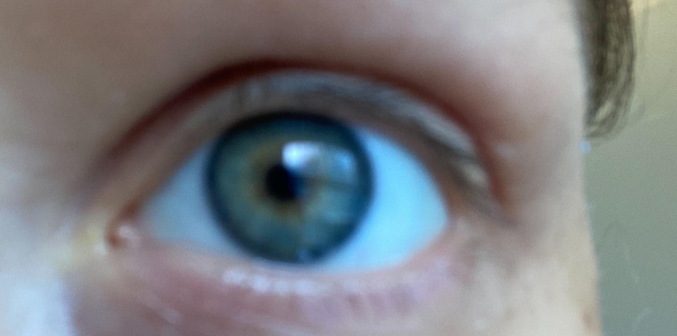 What color are my eyes? | Scrolller