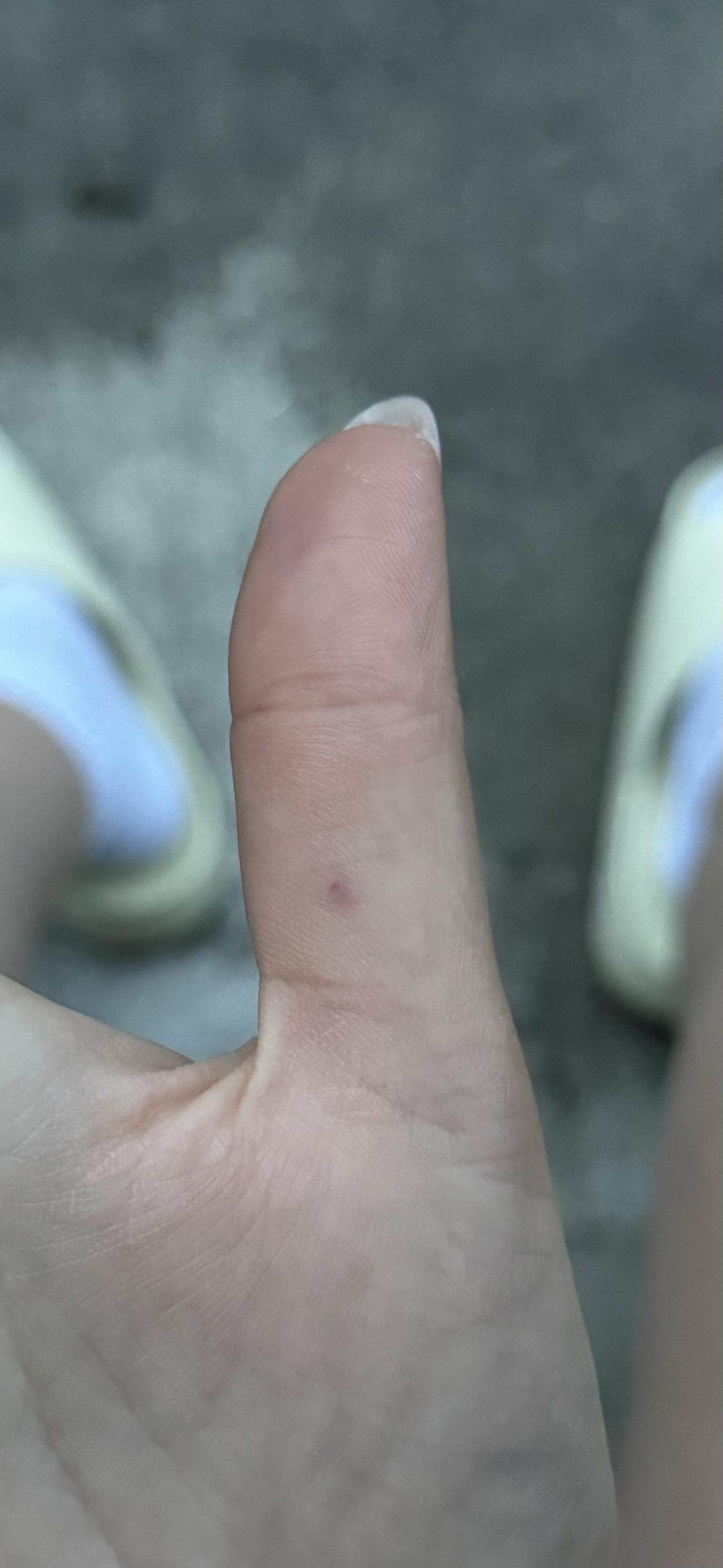 What is this bump? | Scrolller