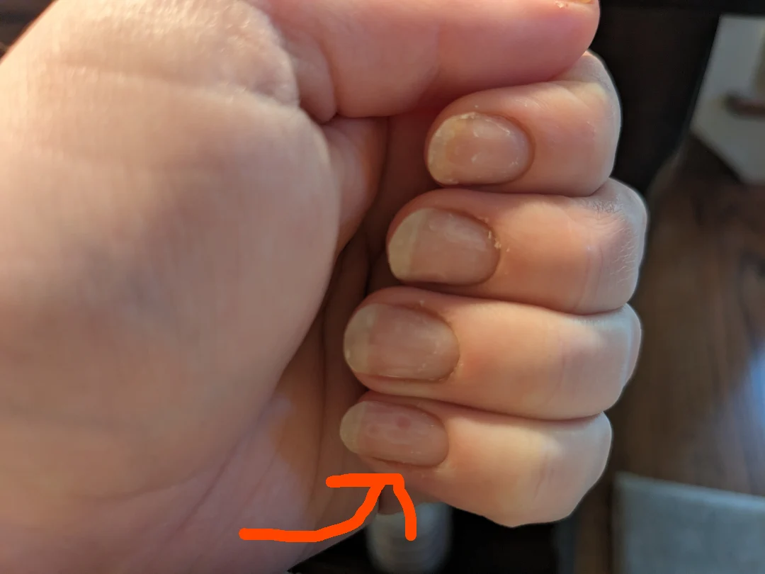 Nail Carnage | Scrolller