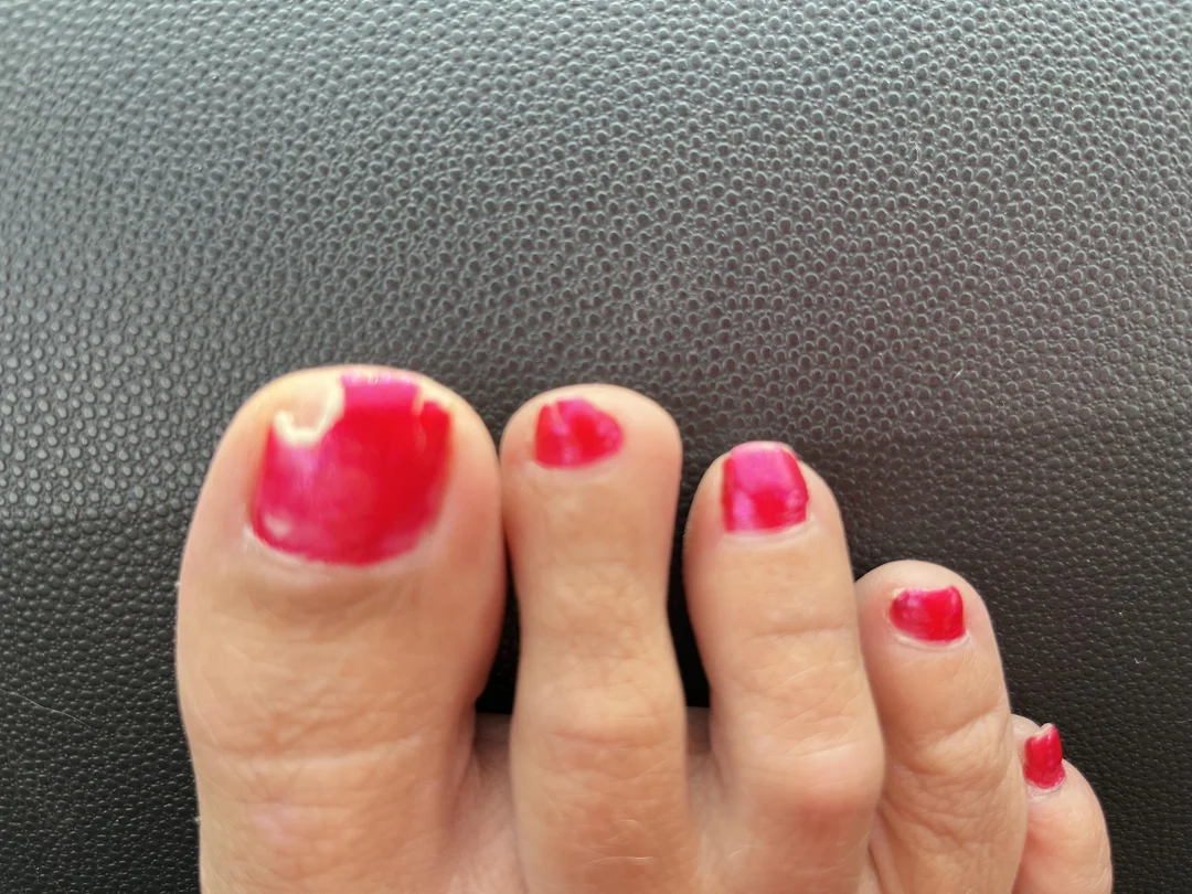 Broken toenail! | Scrolller