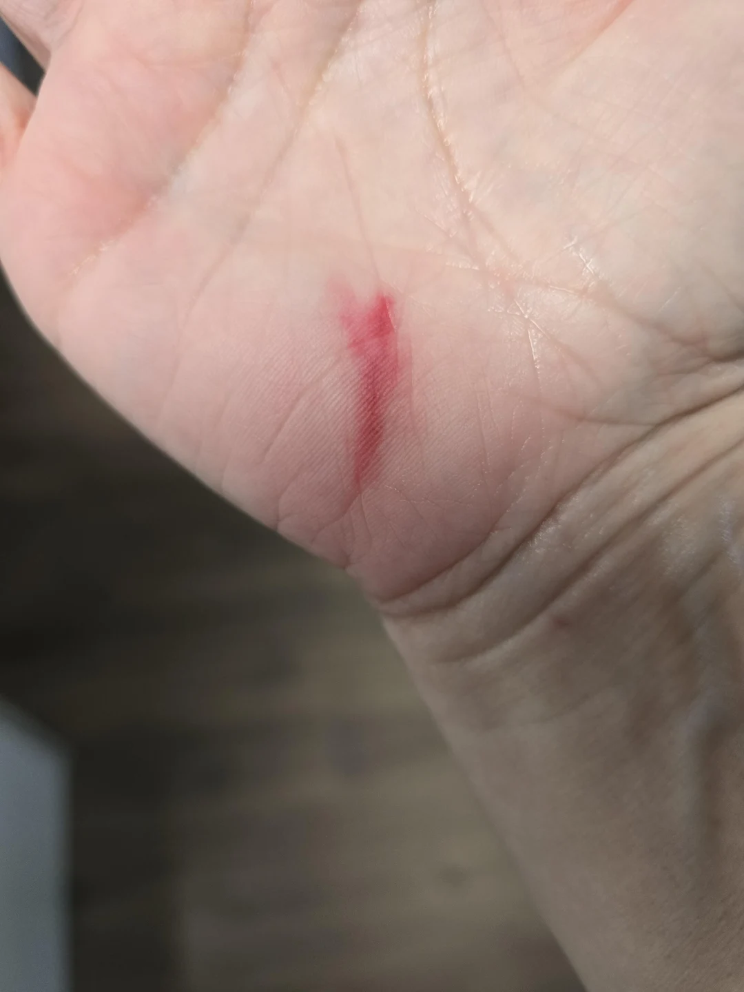 Why do I keep getting this mark on my palm? | Scrolller