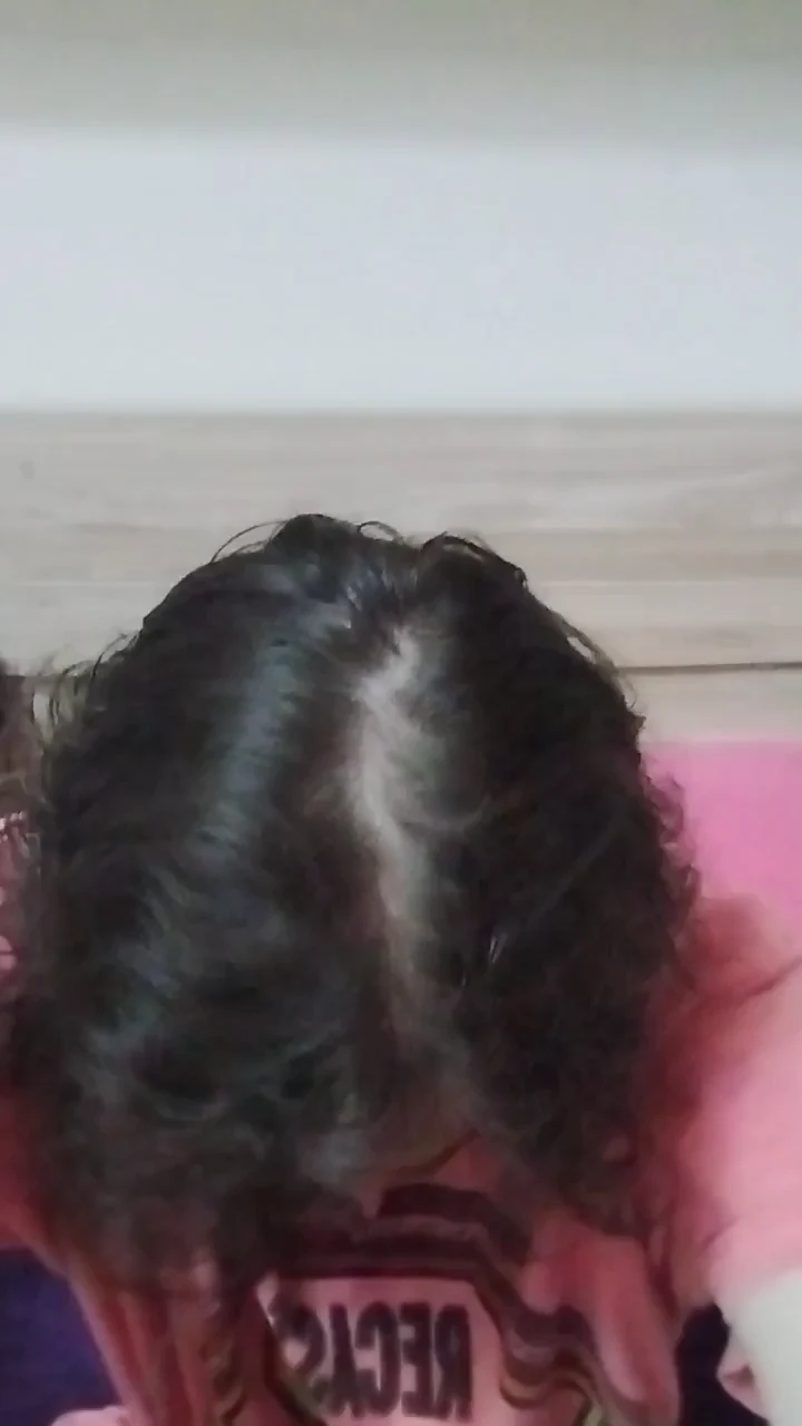 Is it normal to see this much of my scalp? | Scrolller