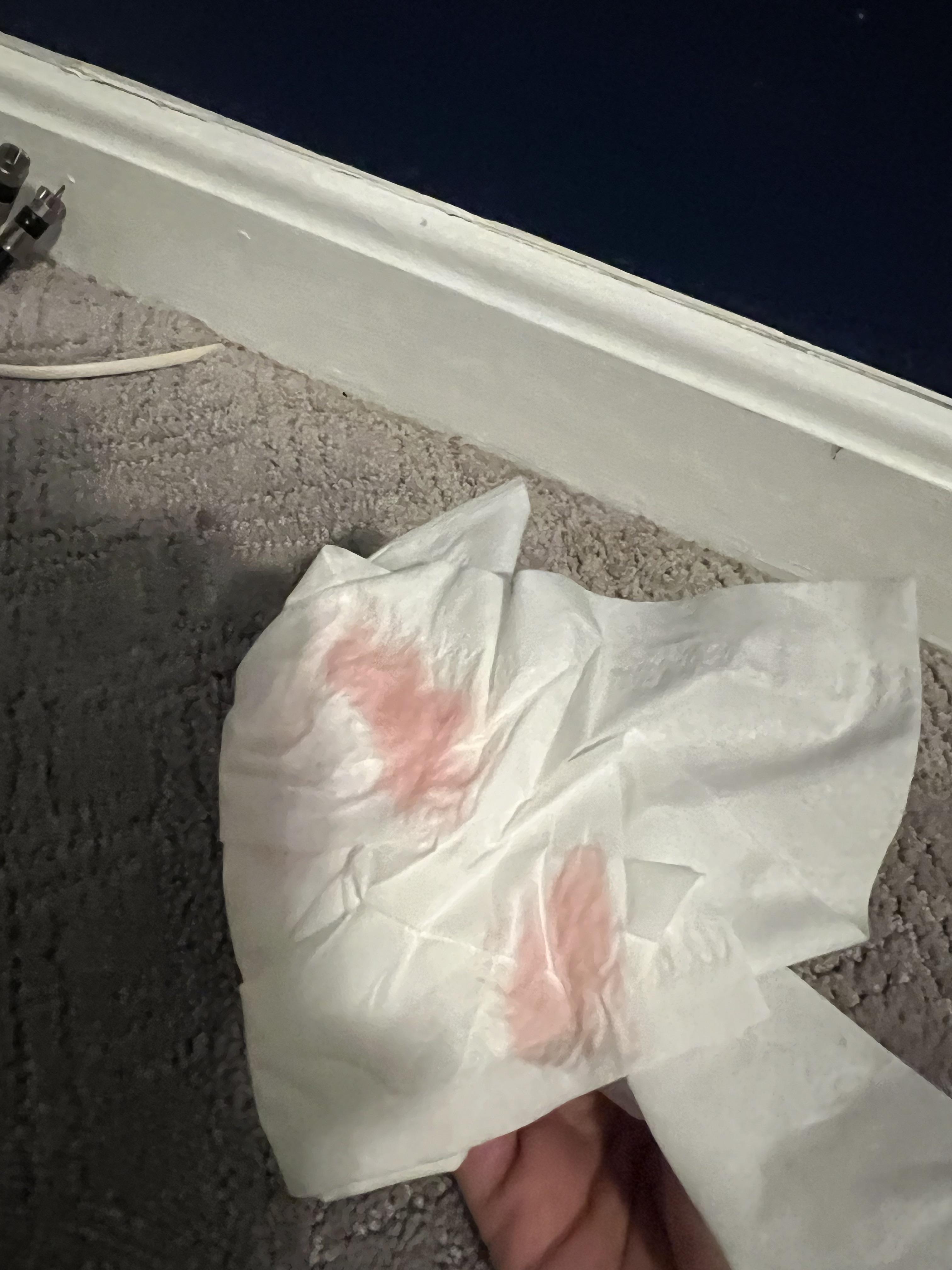 Is this blood in my cat’s vomit? | Scrolller