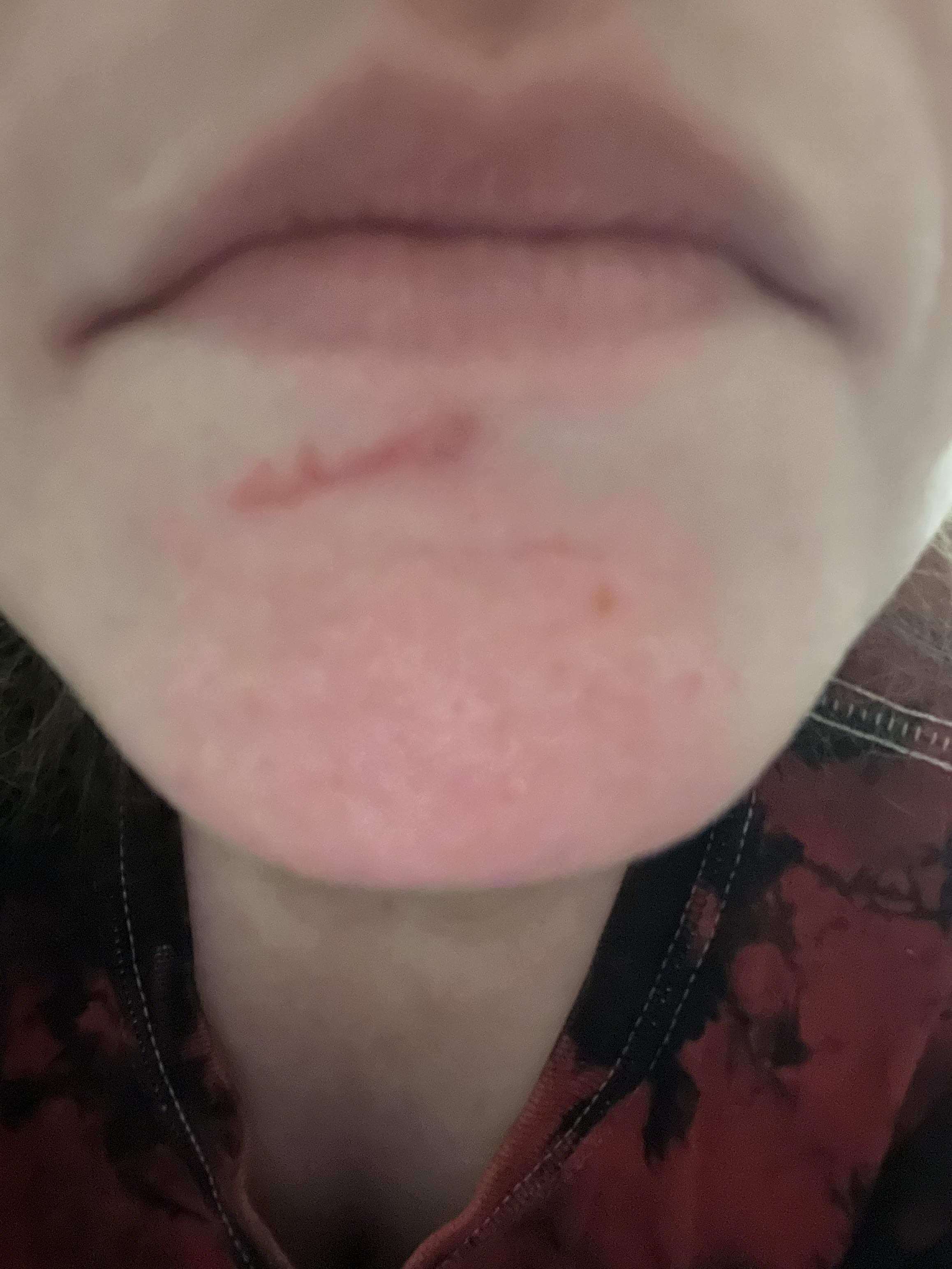 Scar Help! | Scrolller