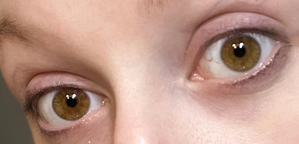 Amber? Light brown? | Scrolller