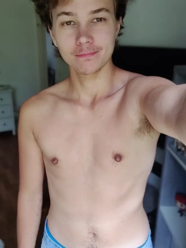 4yrs post-op (peri) | Scrolller