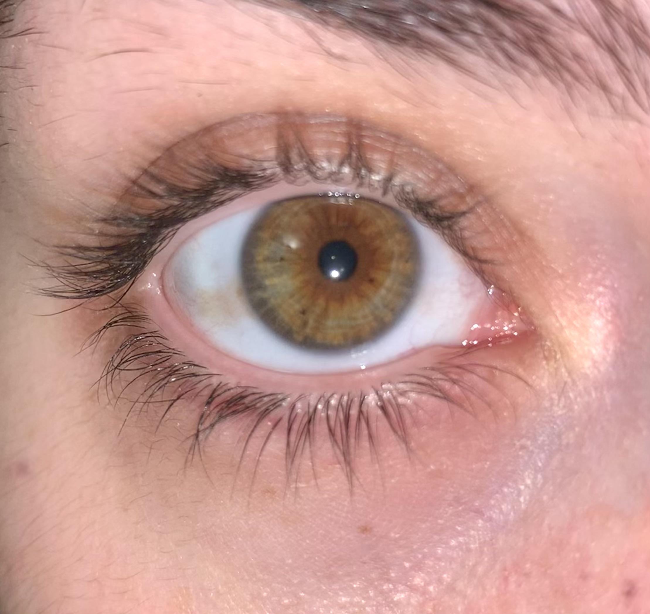 Hazel?? Amber?? | Scrolller