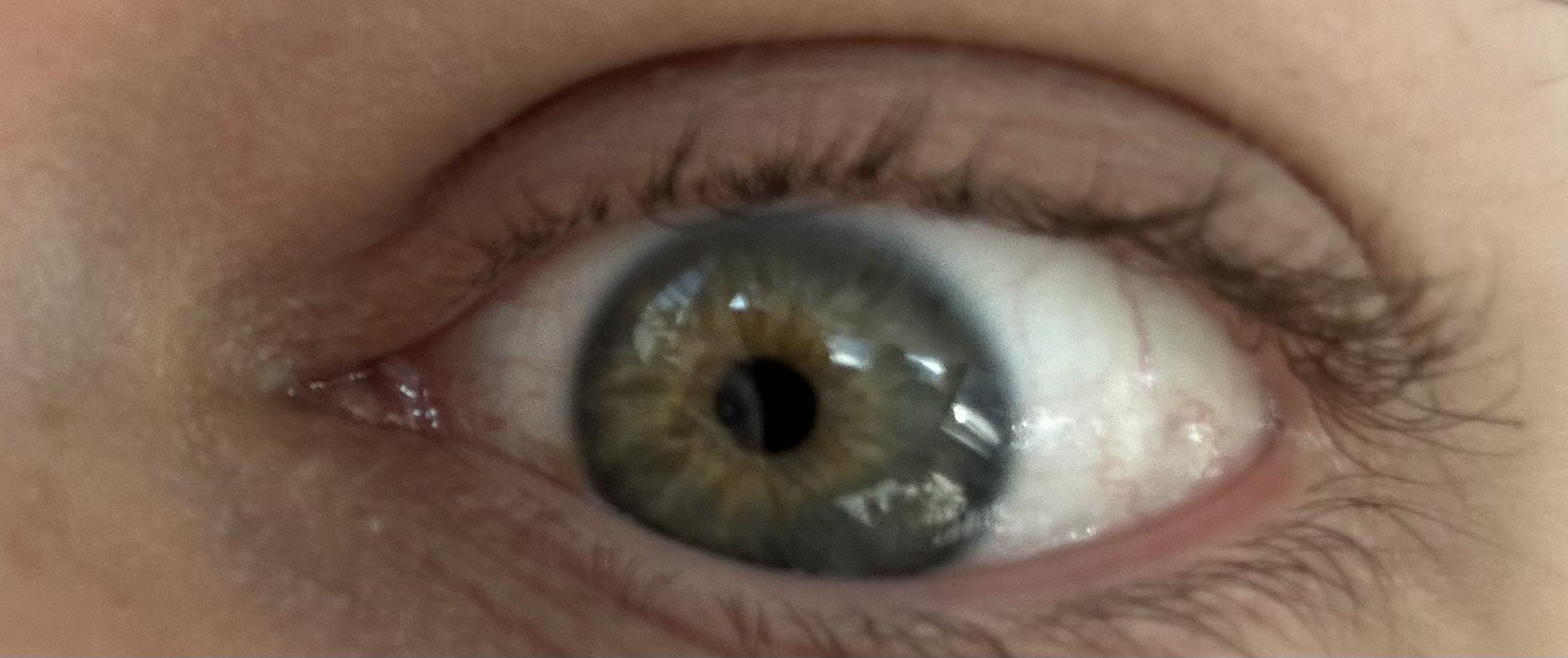 Green w/ Central Heterochromia or Hazel? | Scrolller