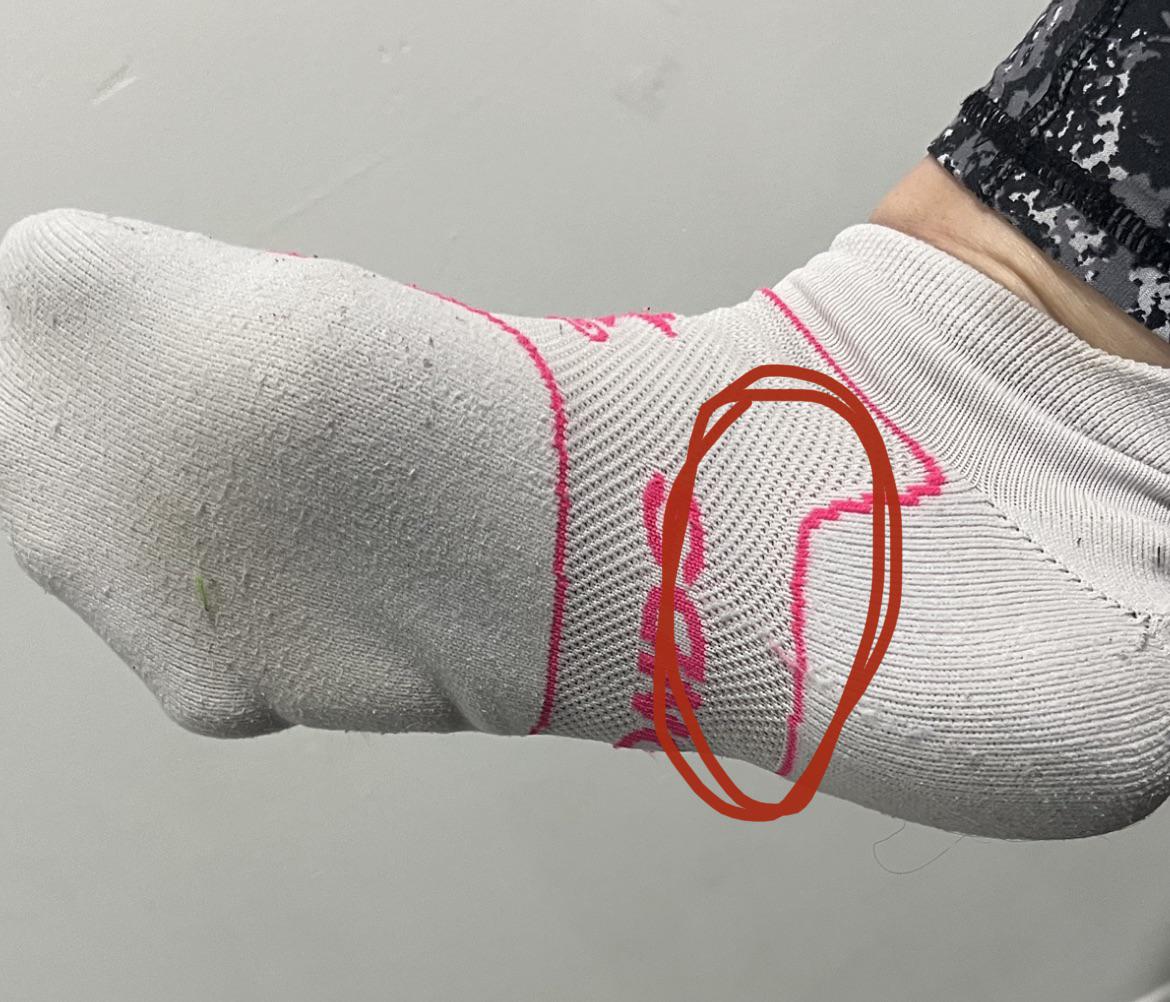 Weird burning tightness on the bottom of my arch? | Scrolller