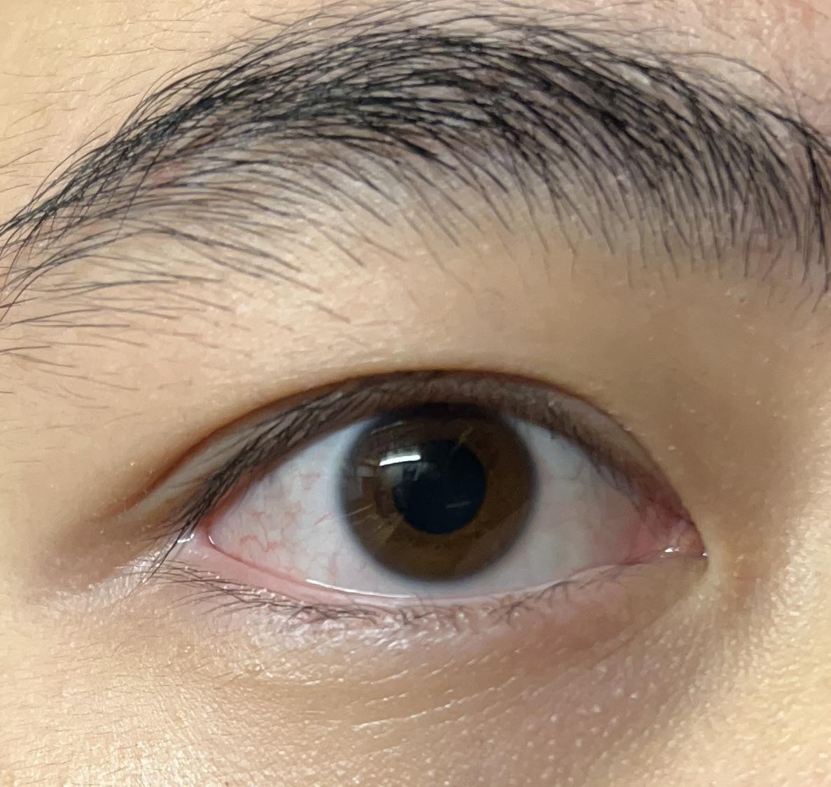 Finally took a higher-quality photo of my r eye | Scrolller
