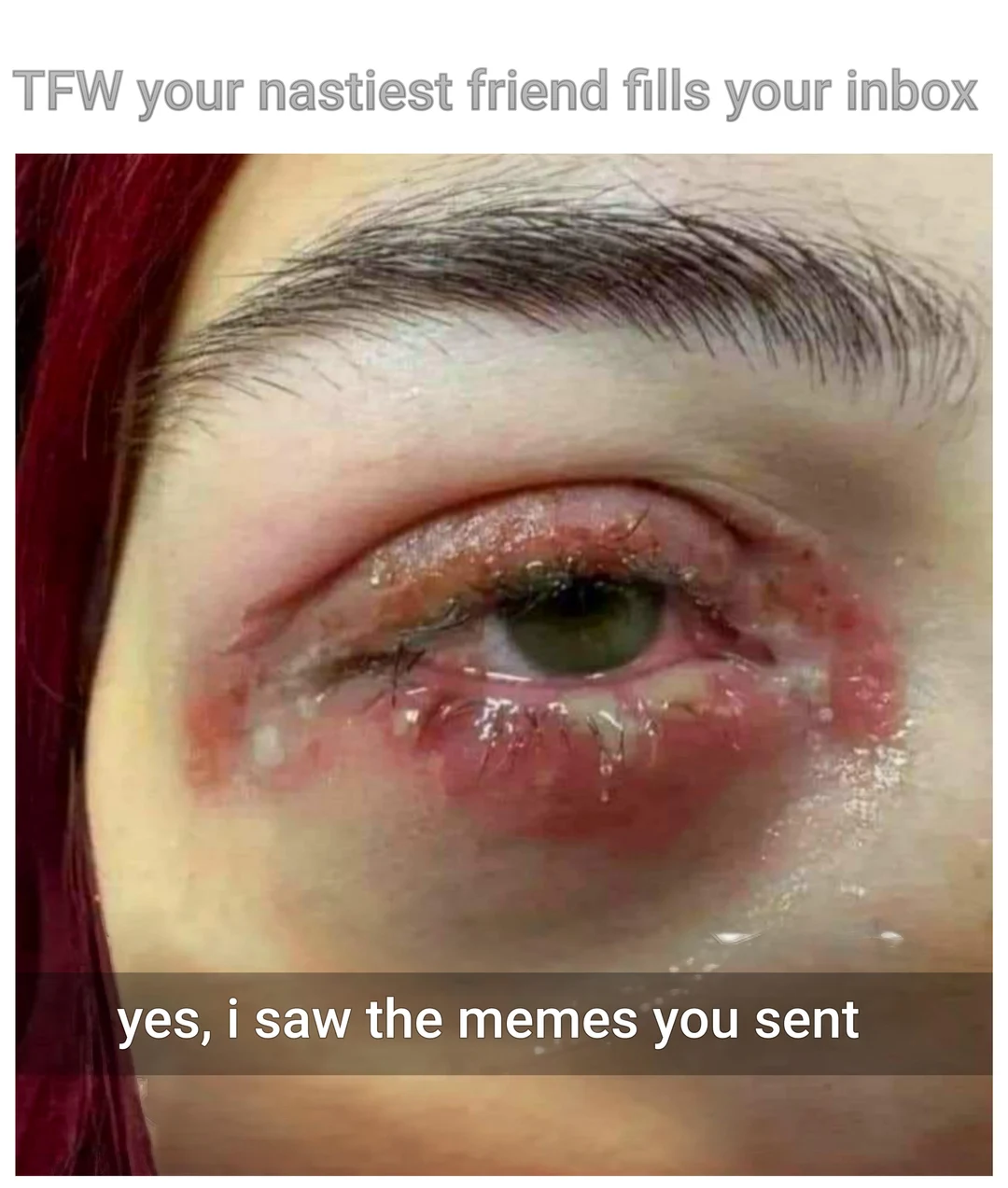 What a terrible day for the sense of sight | Scrolller