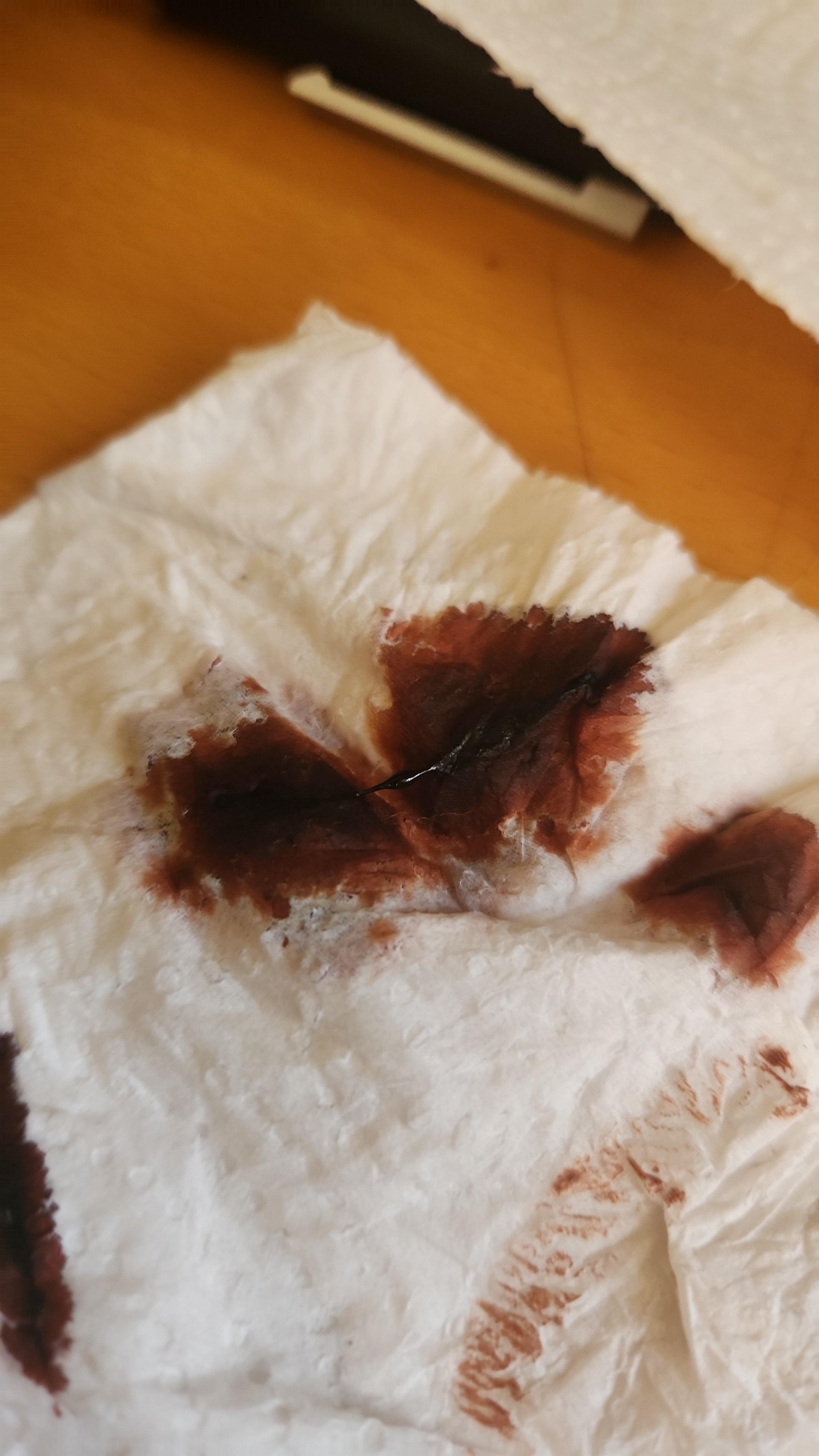 Contaminated inks | Scrolller