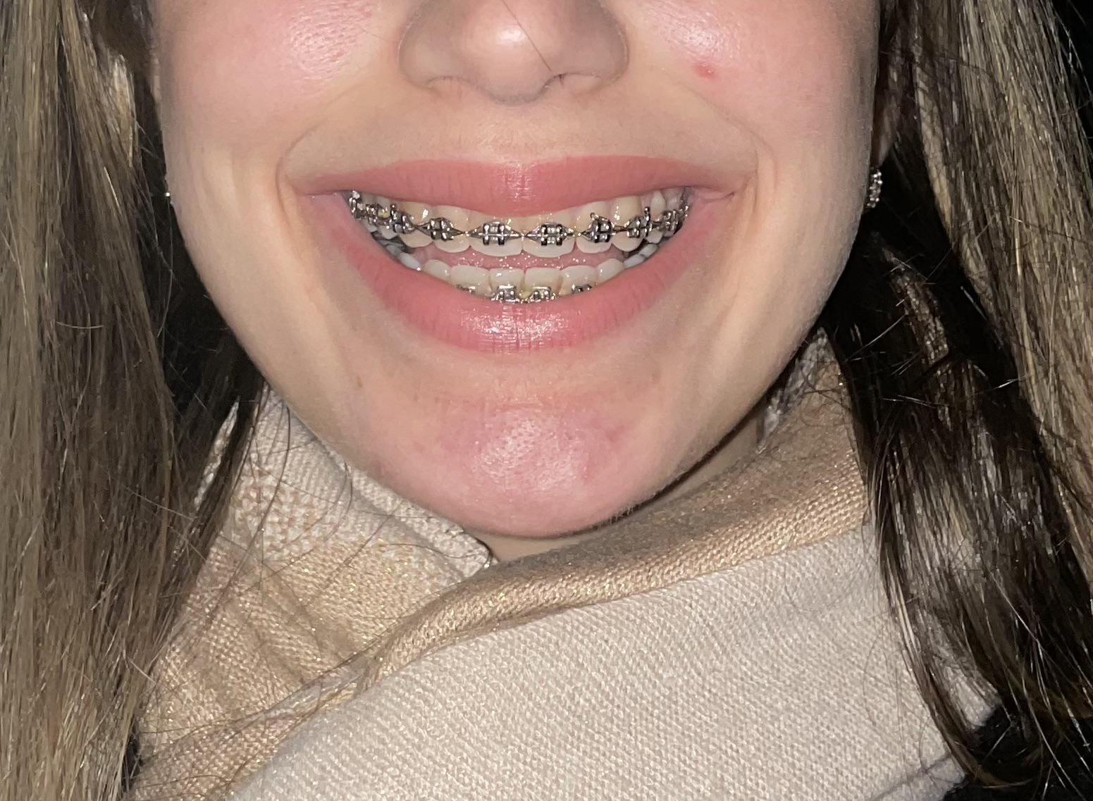 Is my smile asymmetrical? | Scrolller