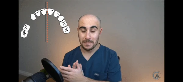 Is it possible to avoid this retraction? | Scrolller