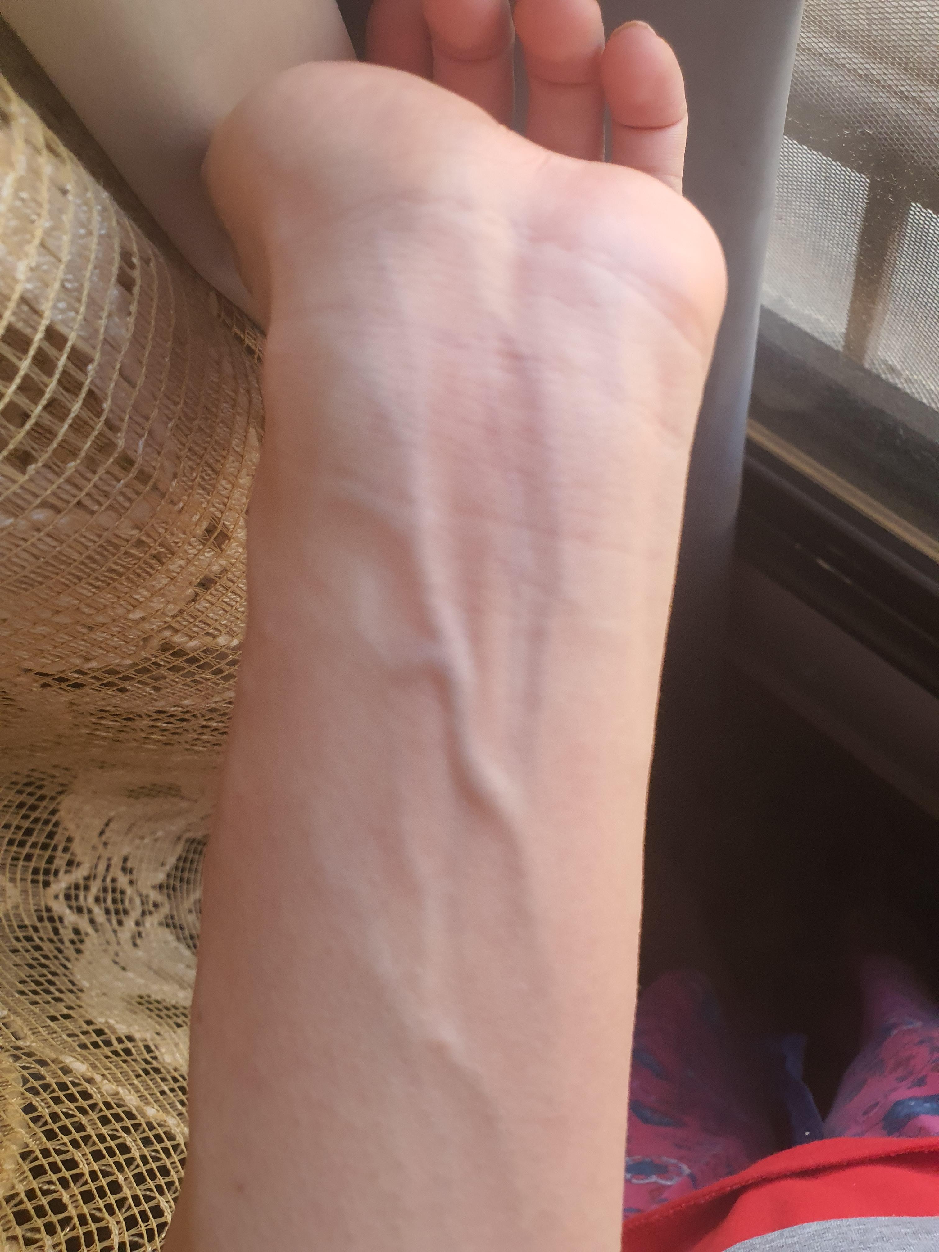 Skin tone | Scrolller