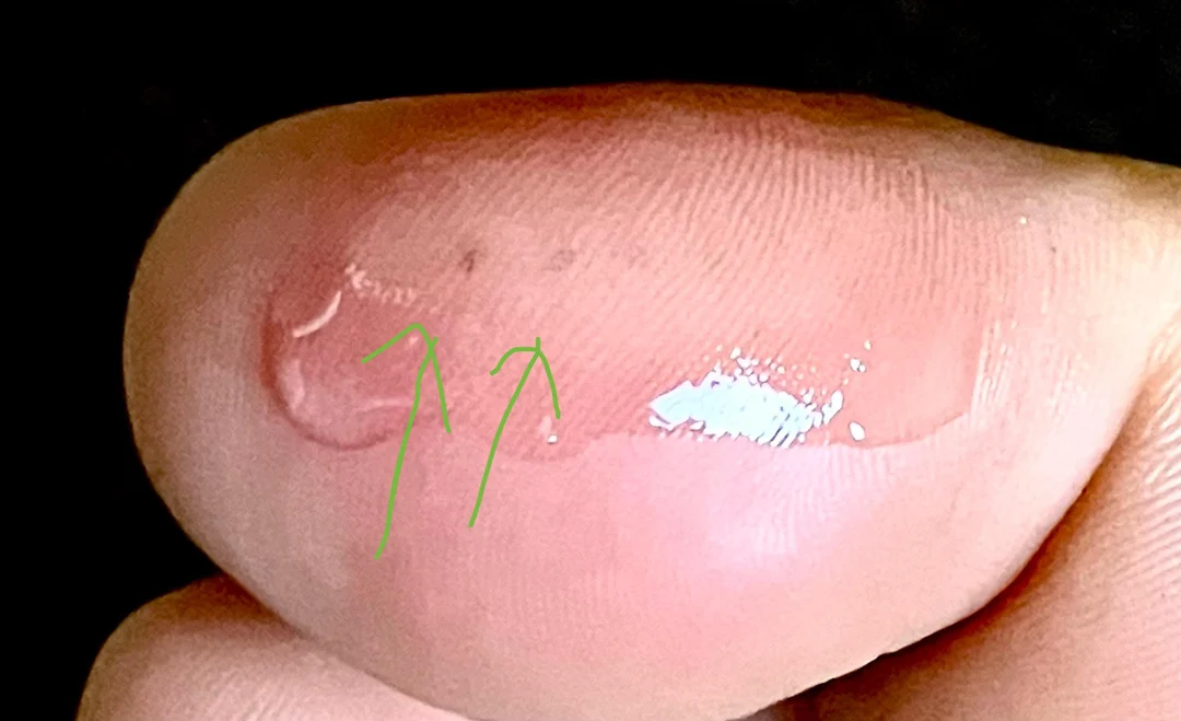 Anyone know what makes this bite or sting? | Scrolller