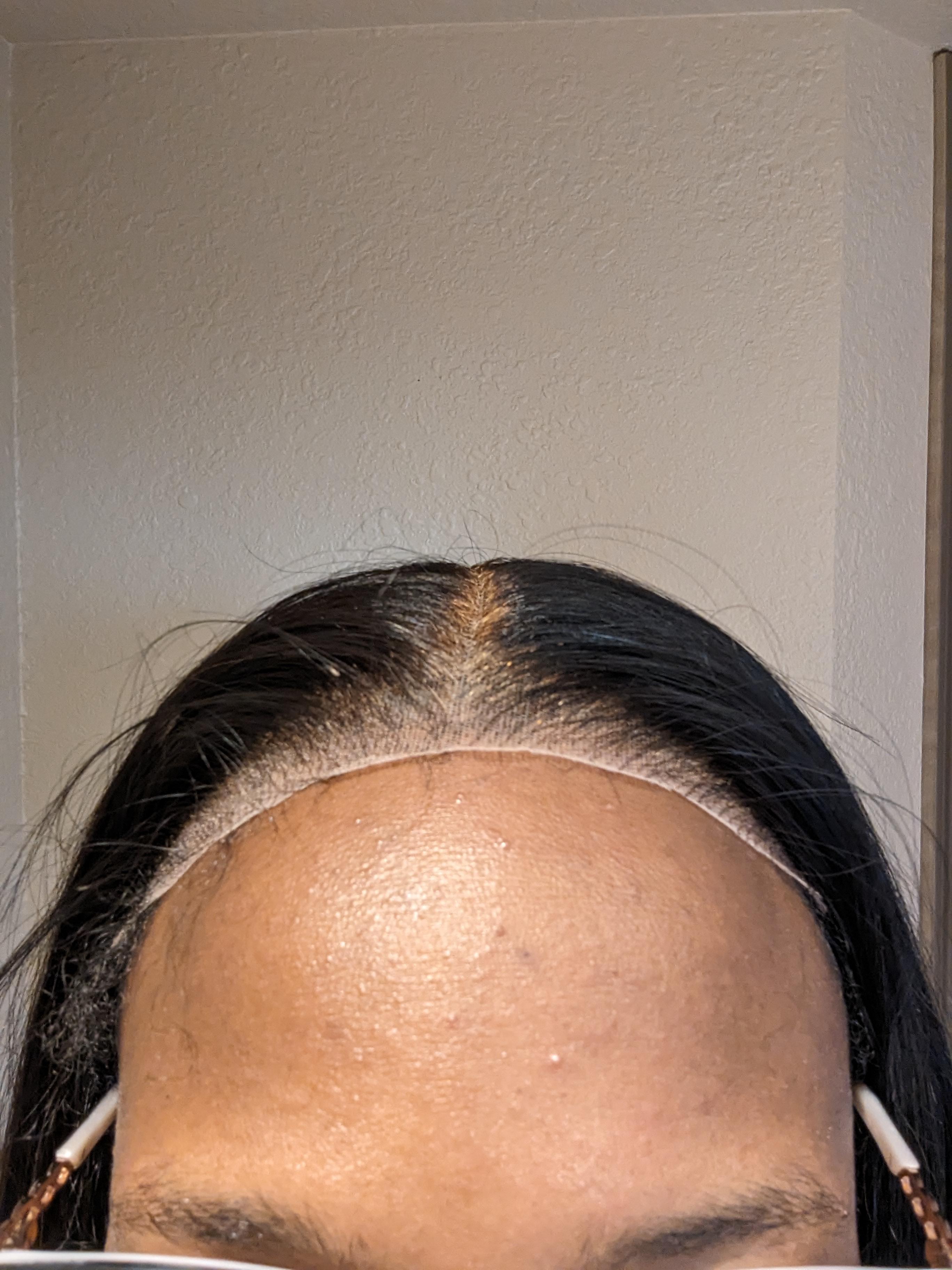 Help with installing this wig? | Scrolller