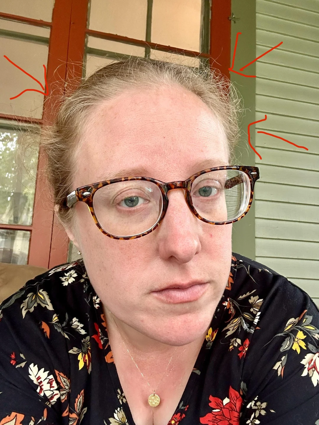 How do I tame these?!? | Scrolller