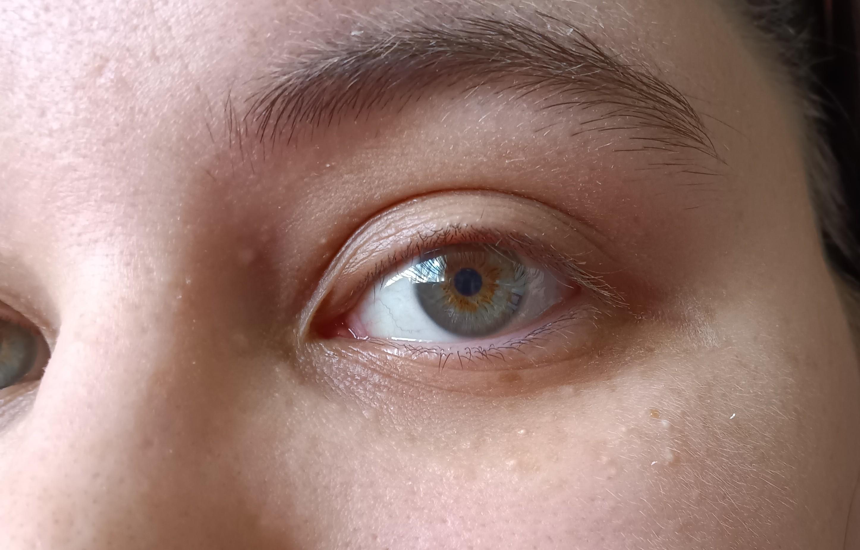 Peep my peeper | Scrolller