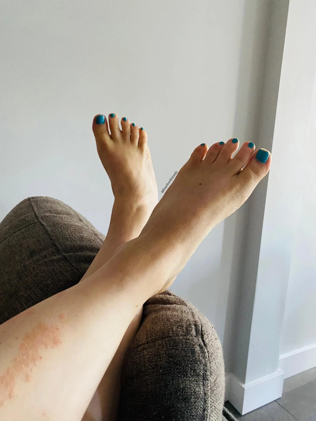 Hard working feet needing some TLC | Scrolller