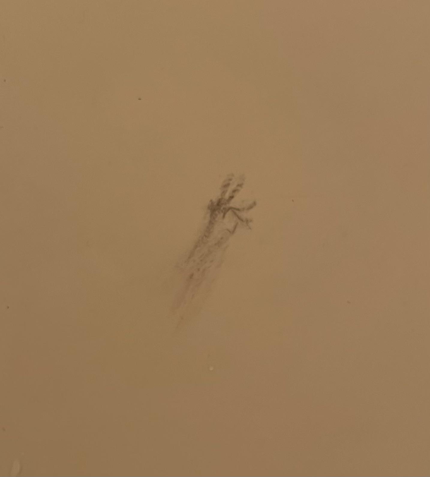Squashed mosquito viscera looks like its shadow | Scrolller
