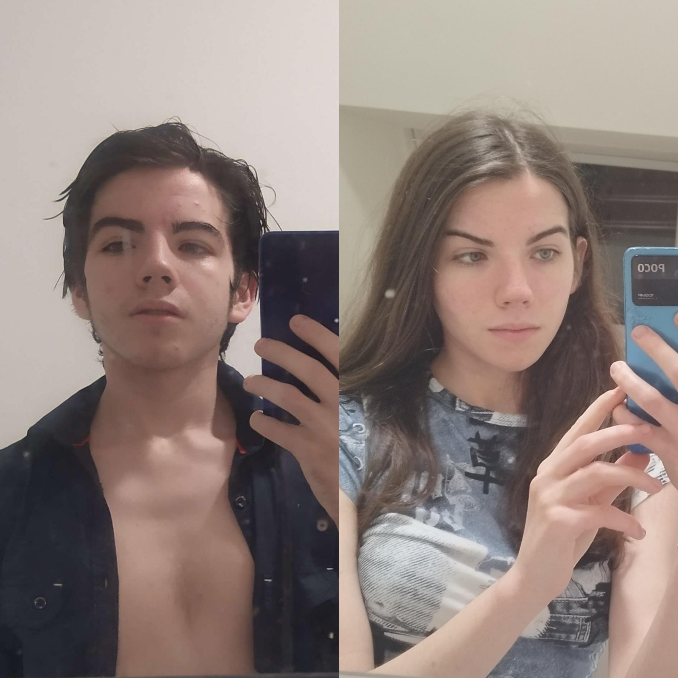 Before vs 2 years HRT MtF 🔥 | Scrolller