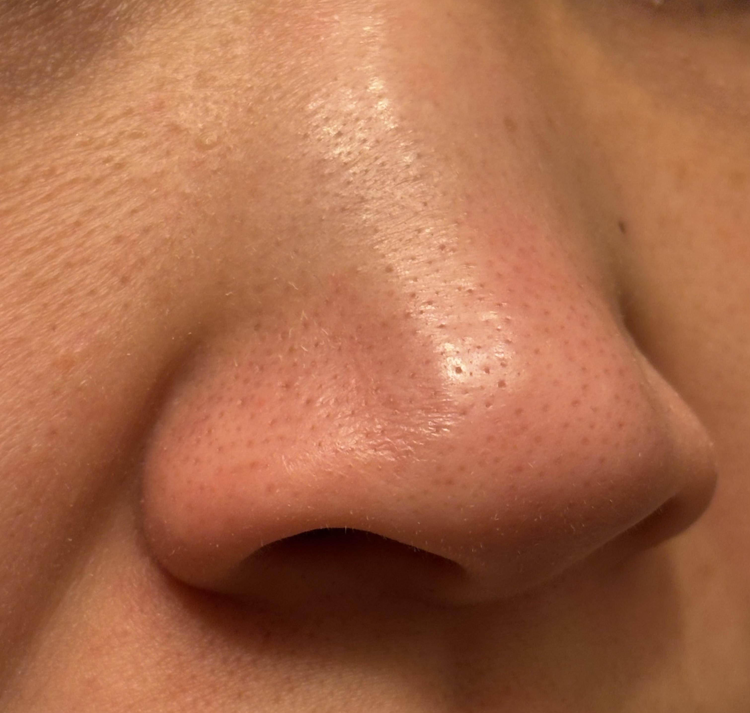 Product recommendations?? | Scrolller