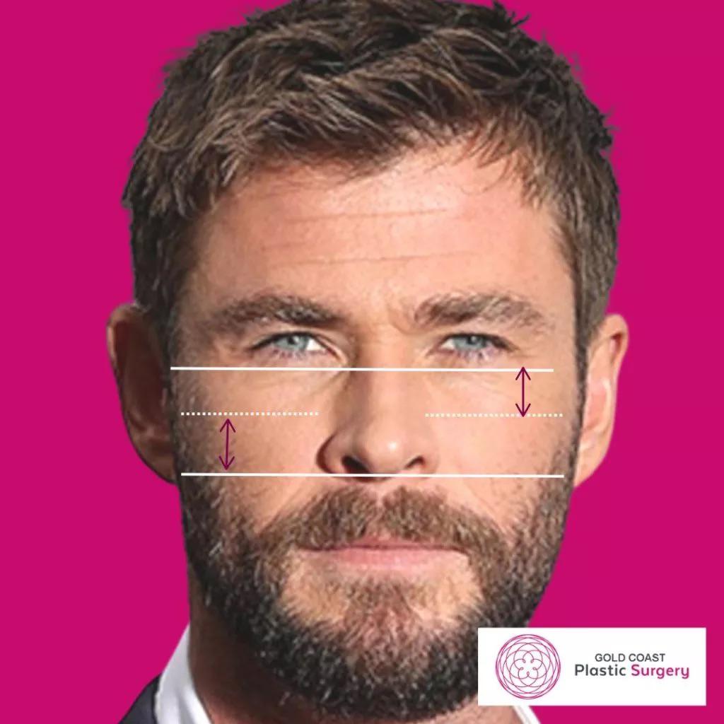 What exactly does high cheekbones mean? | Scrolller