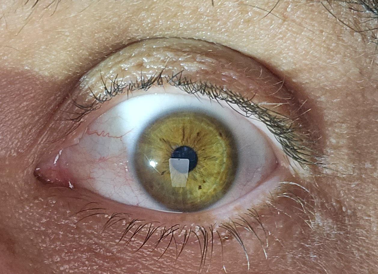 I've always be told Hazel? | Scrolller