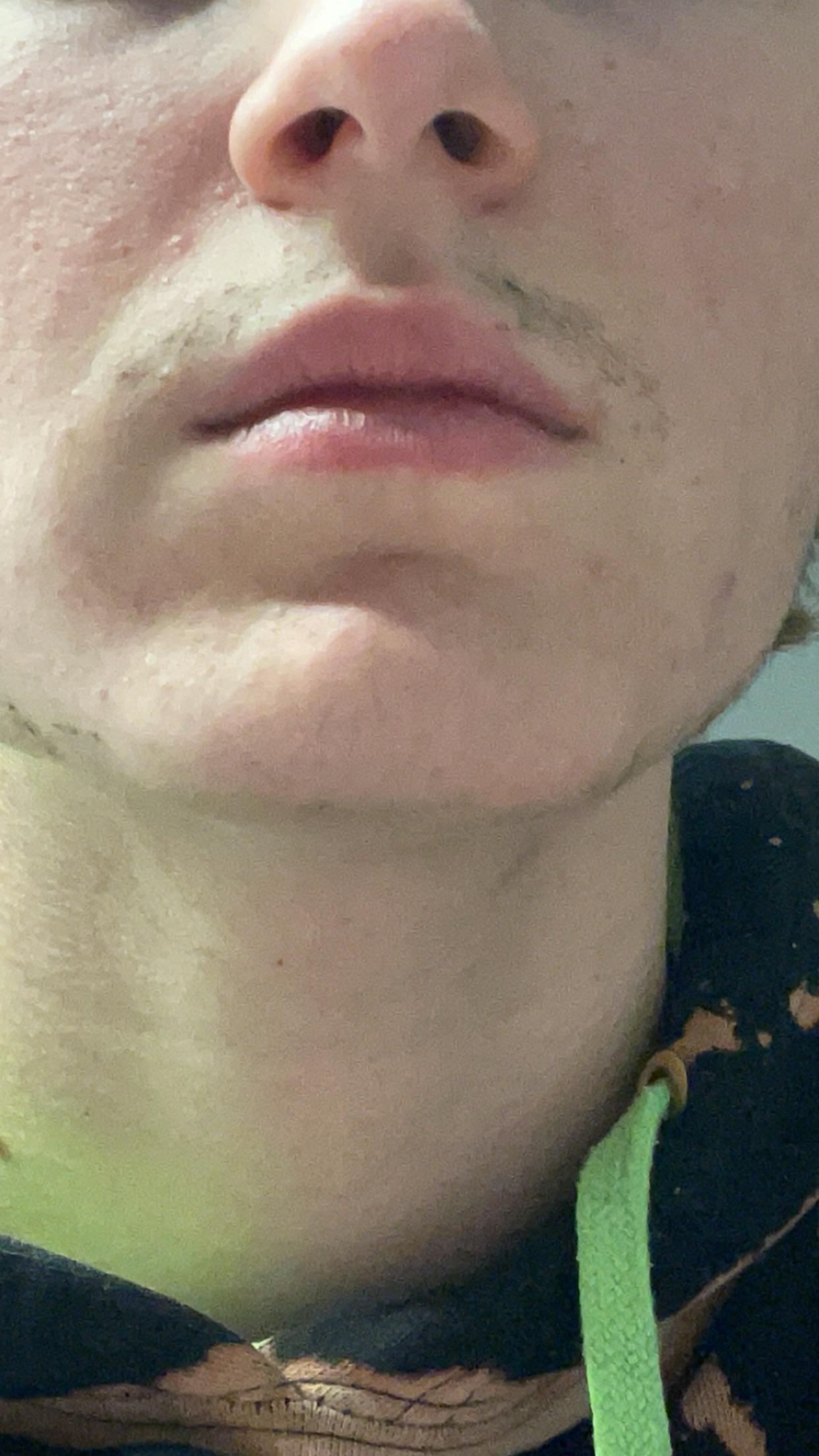 Dying my "beard" | Scrolller