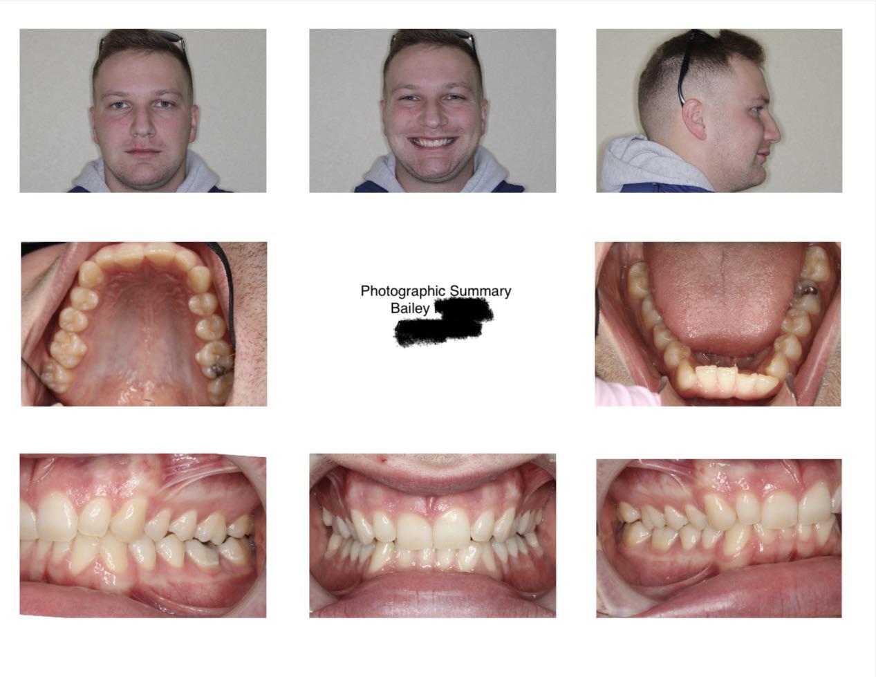 COMPLETED! | Scrolller