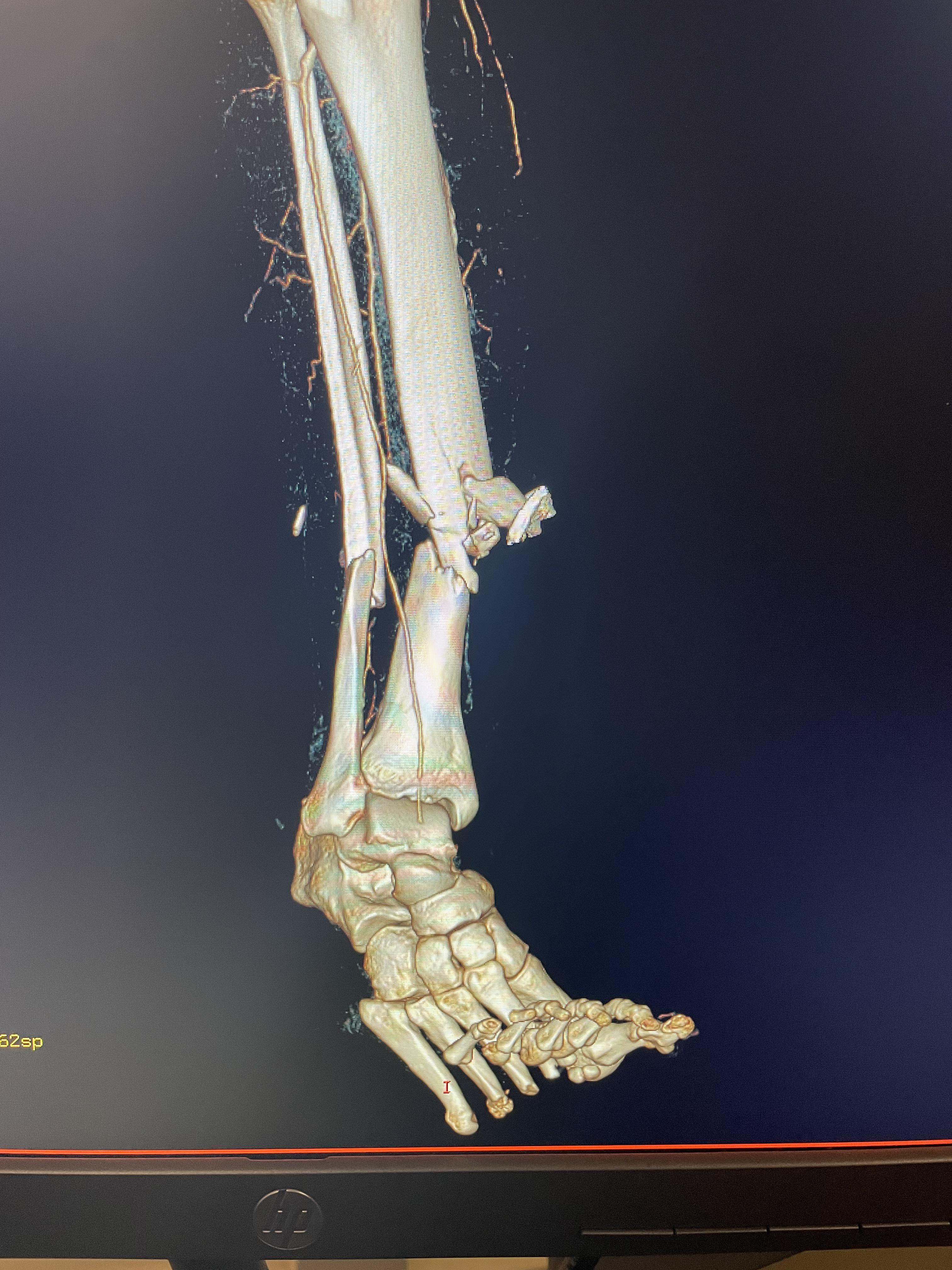 Trauma- Motorcycle vs Car | Scrolller