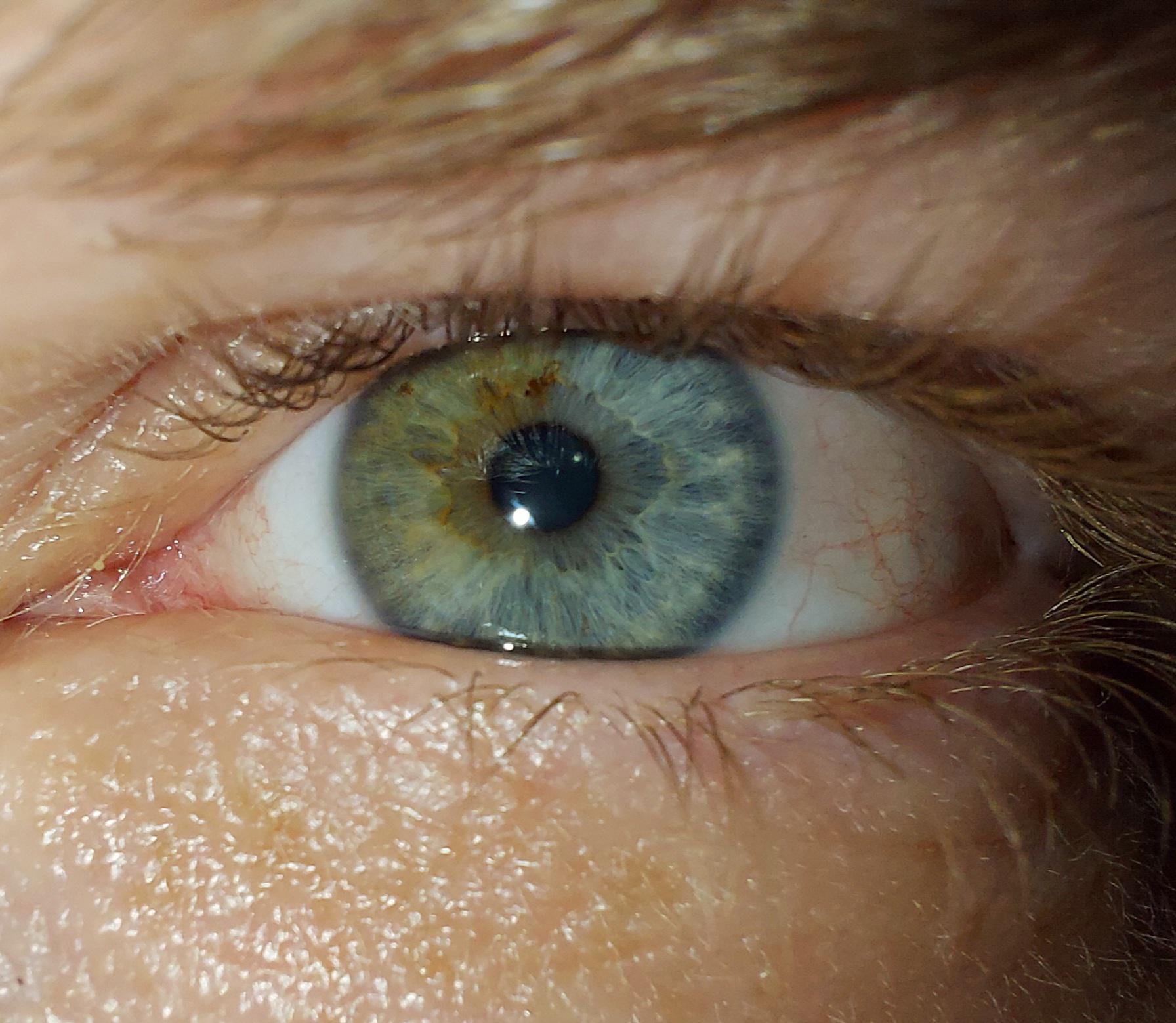 Both of my peepers. | Scrolller