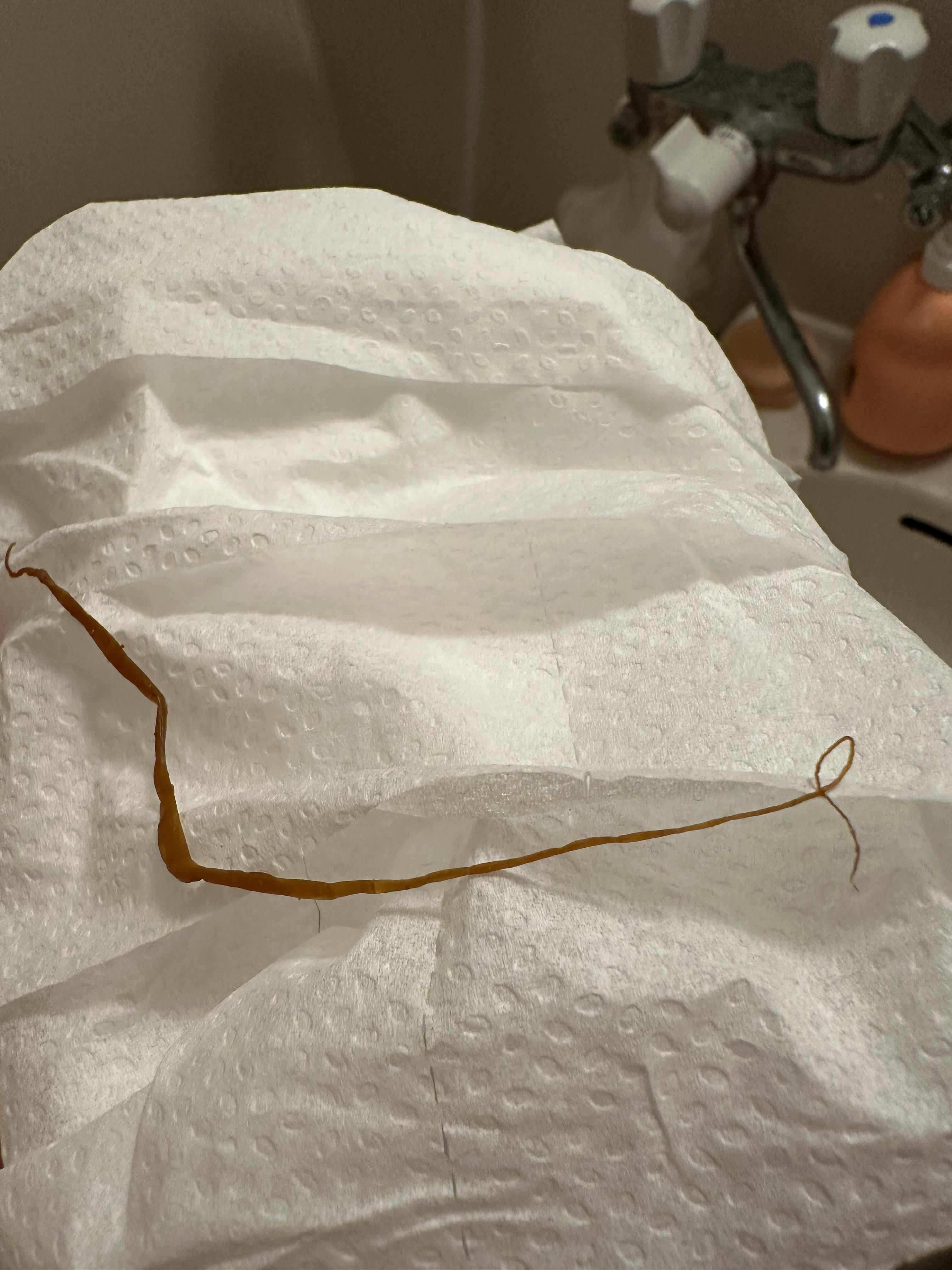 Is this a parasite? Please help | Scrolller