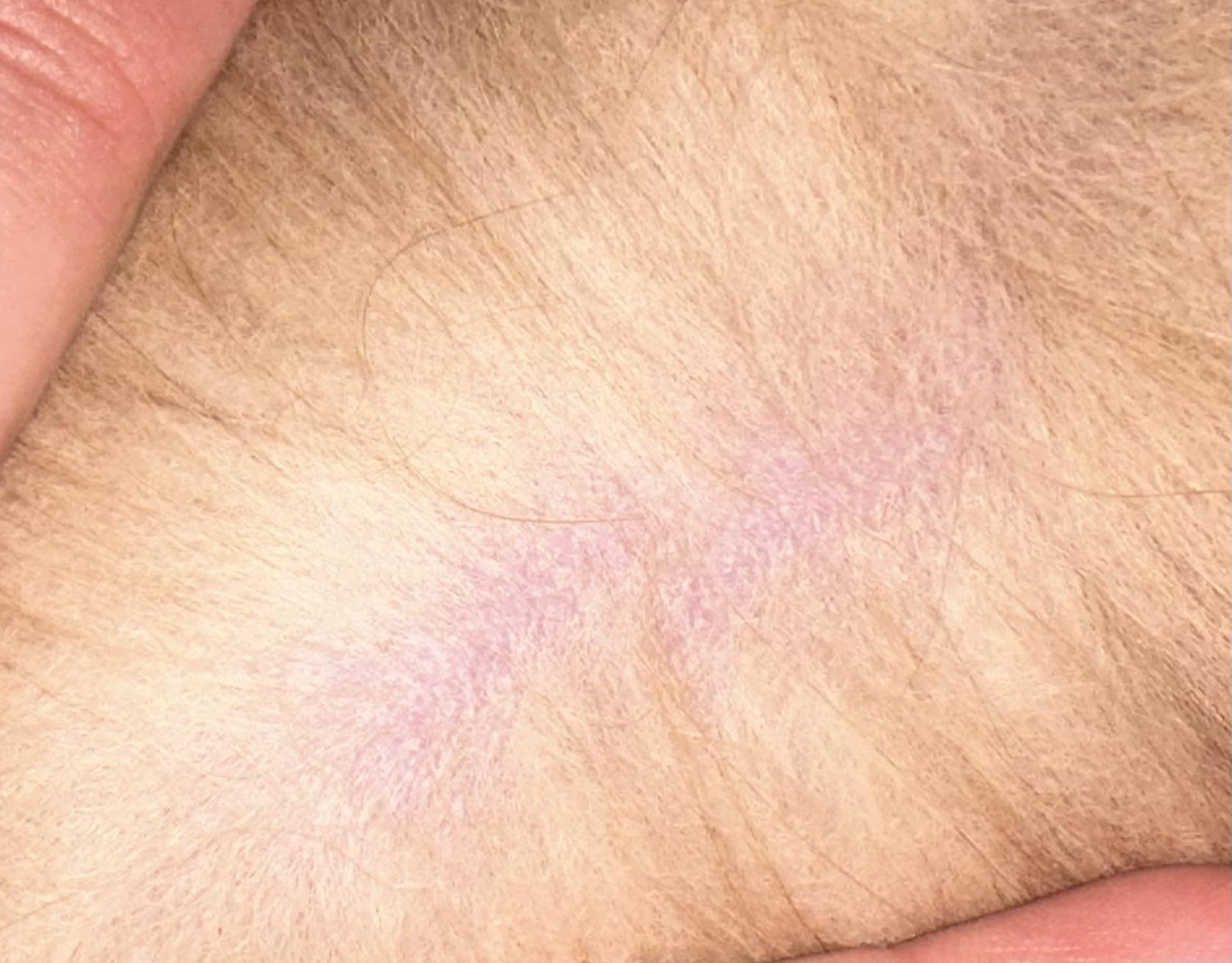 Skin problems??? | Scrolller