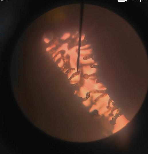 Bud under a microscope | Scrolller