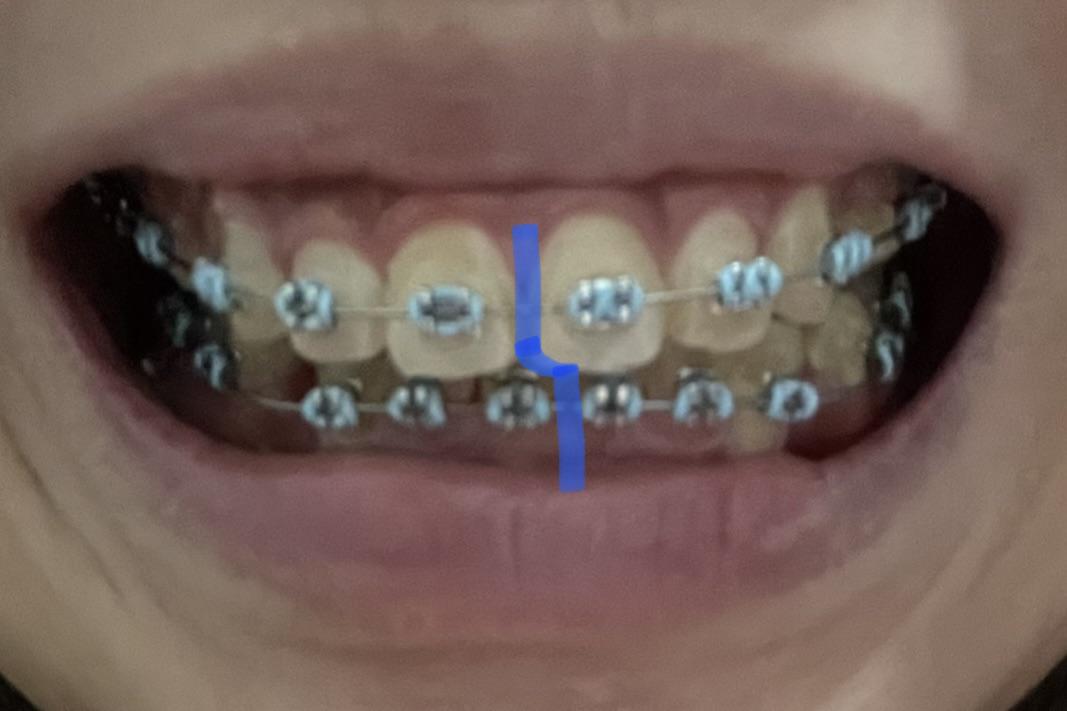 Loving the midline changes! | Scrolller