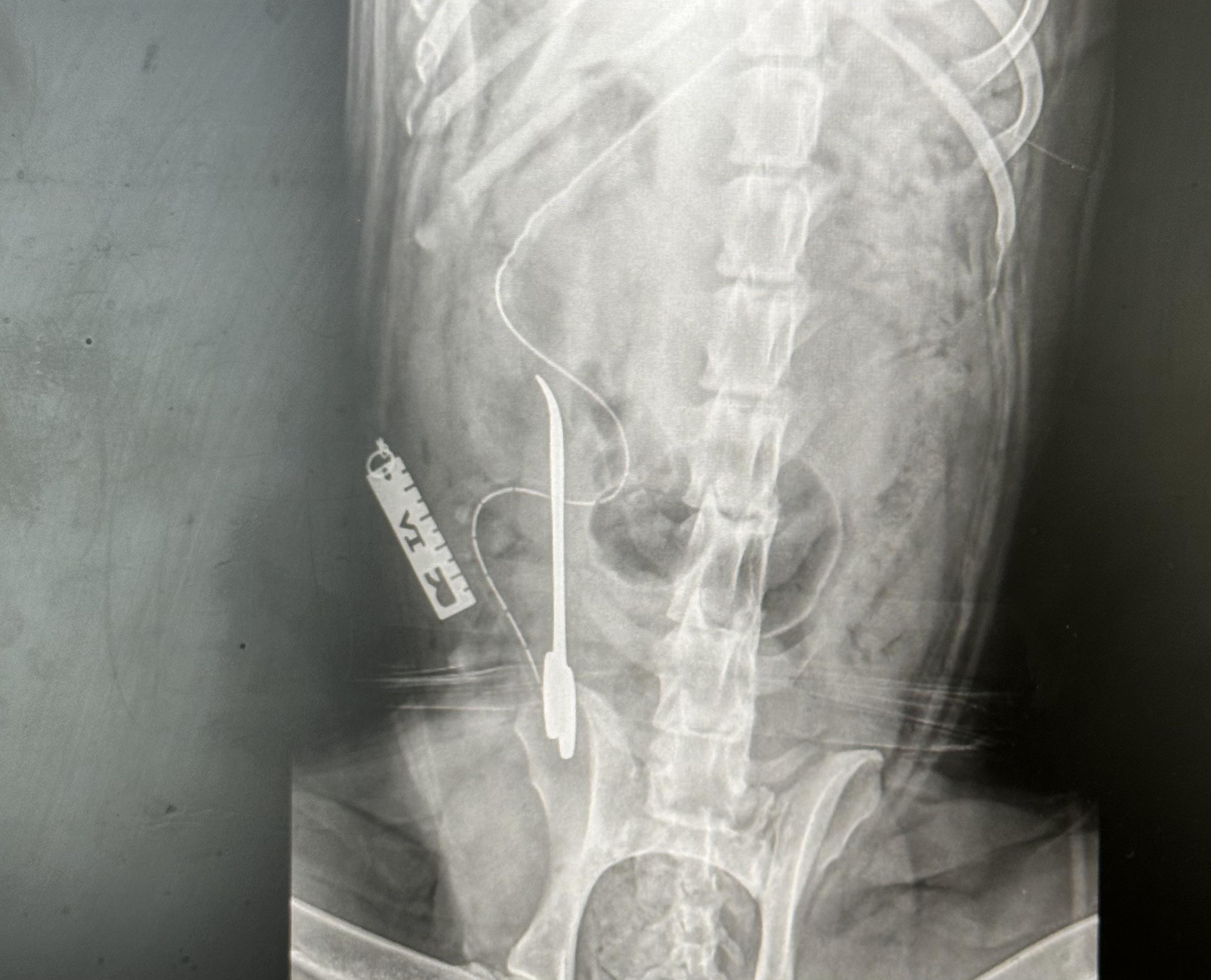 Speechless | Scrolller