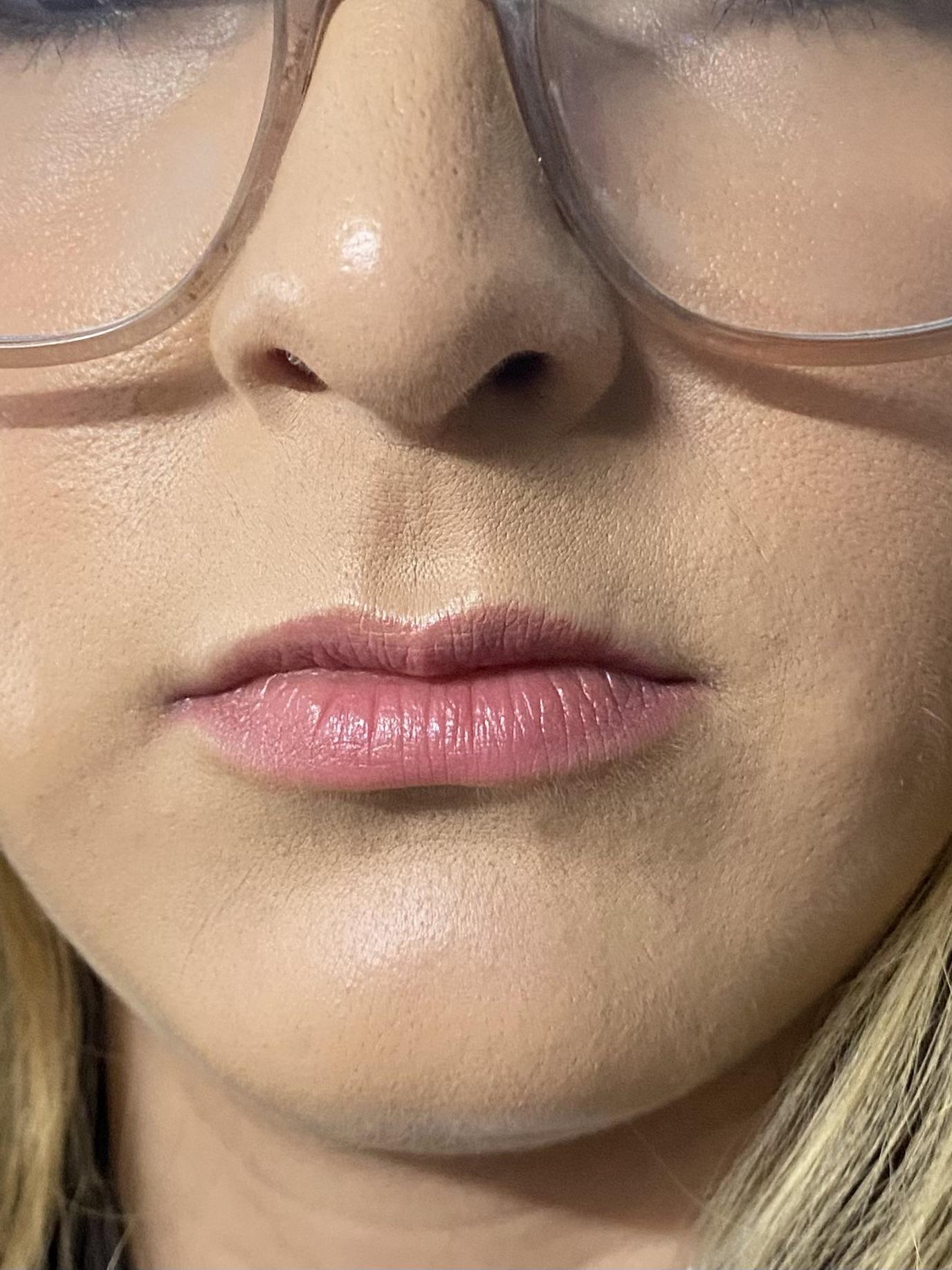 Is it normal for foundation to do this?? using il makiage full coverage. I don’t know how to ...