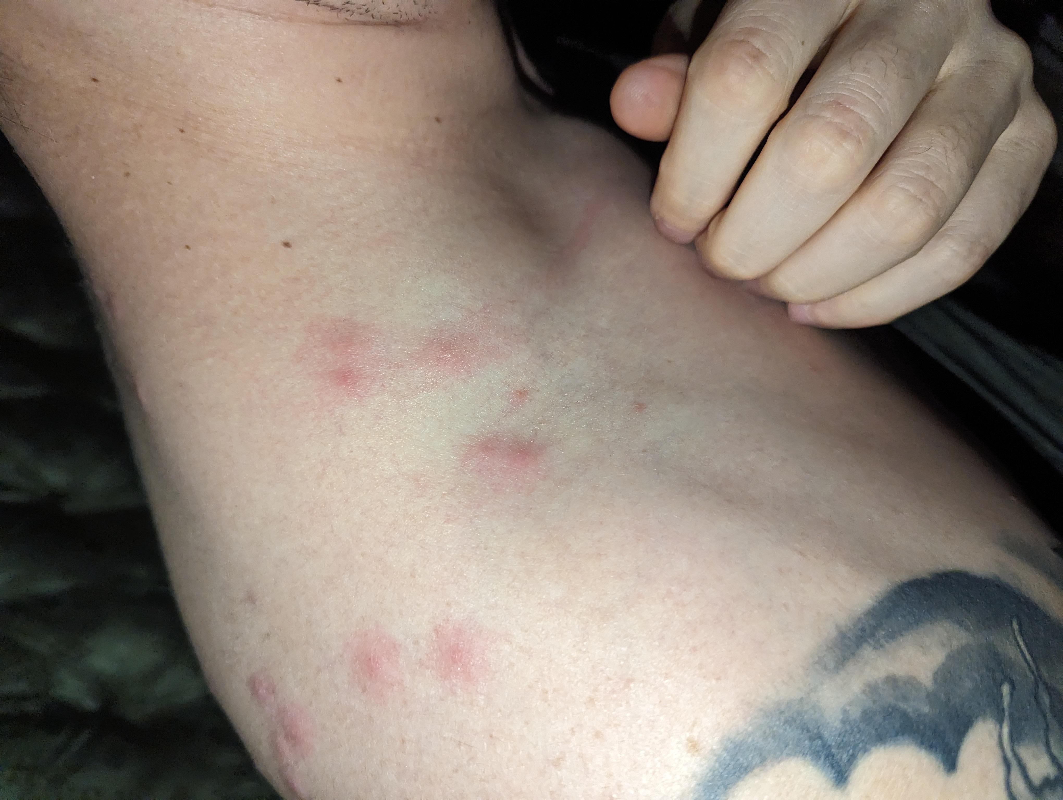 What are these red bumps? | Scrolller