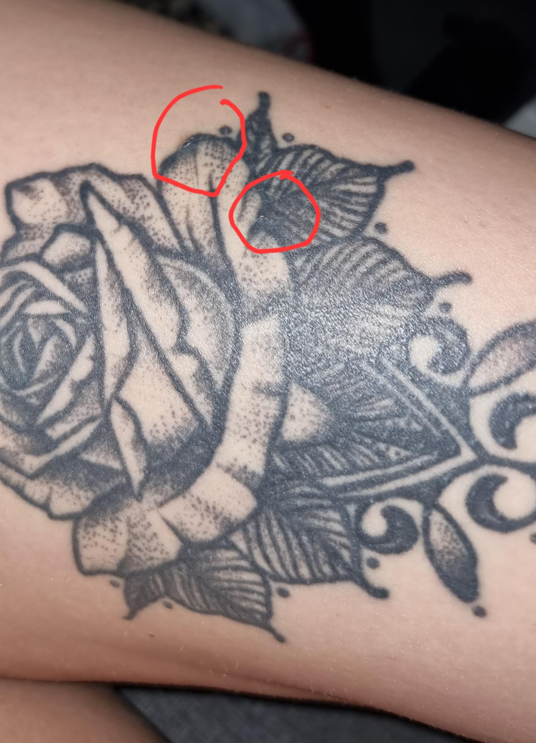 Tattoo developing weird bumps/disintegrating? | Scrolller