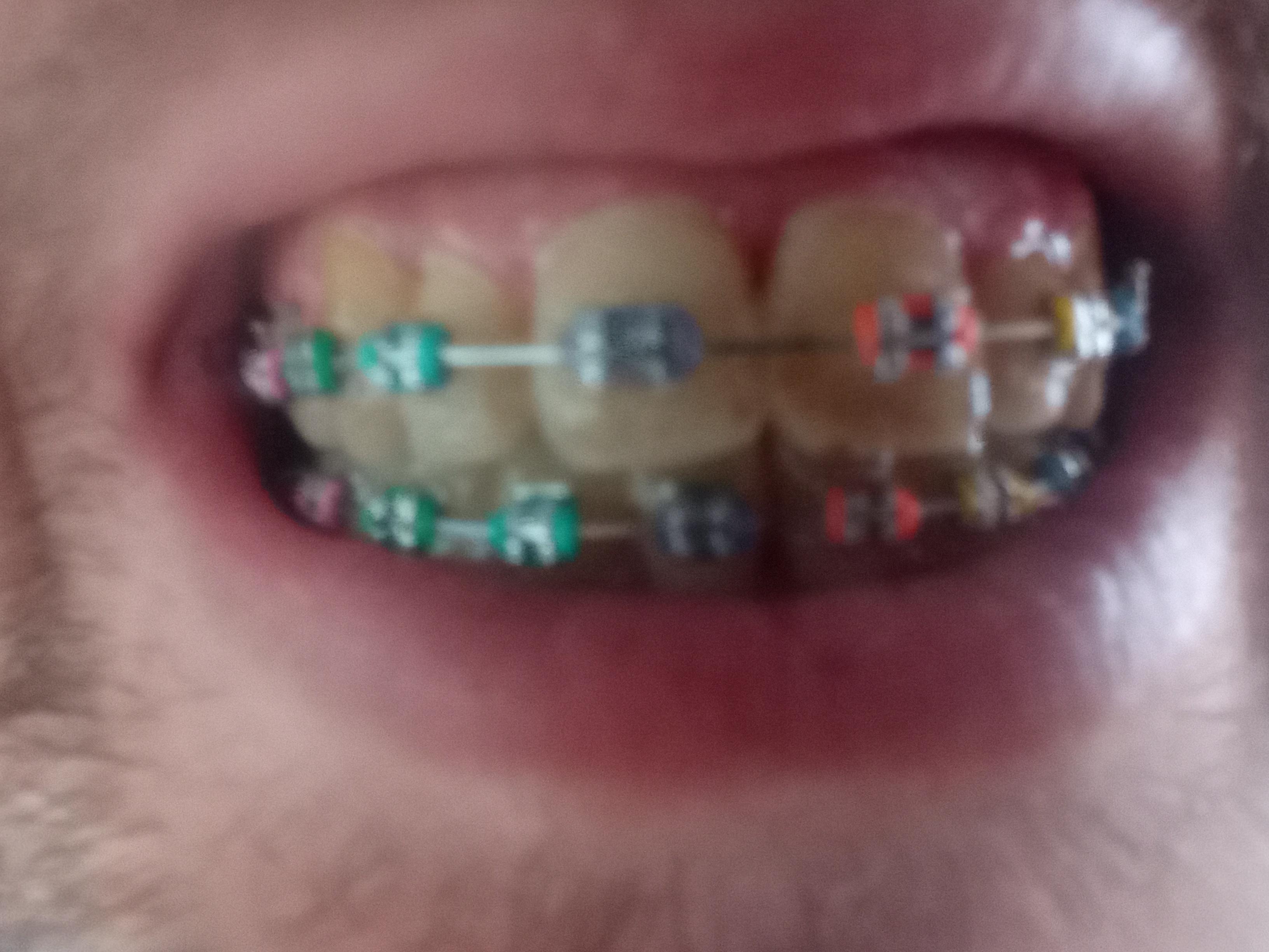 New appointment | Scrolller