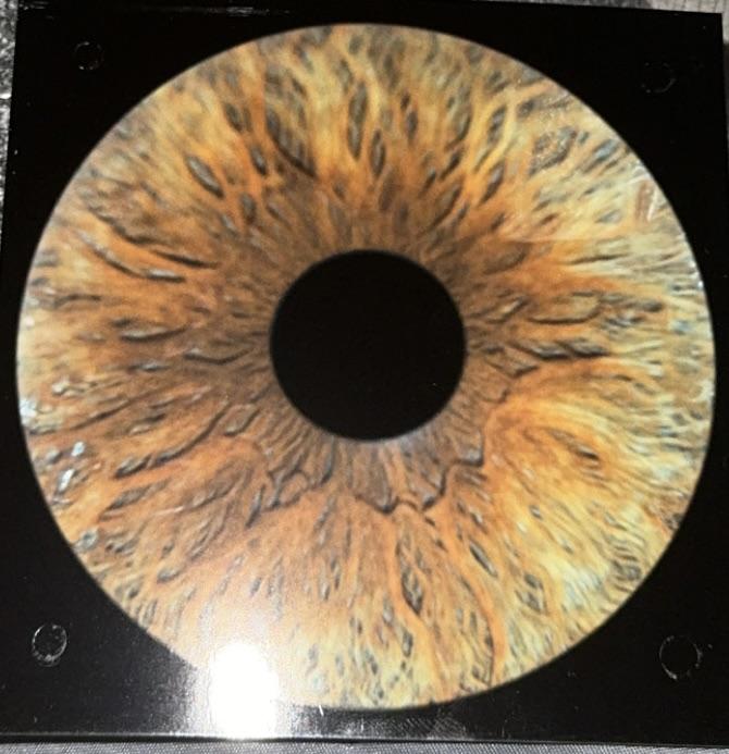 Iris Pic | Scrolller