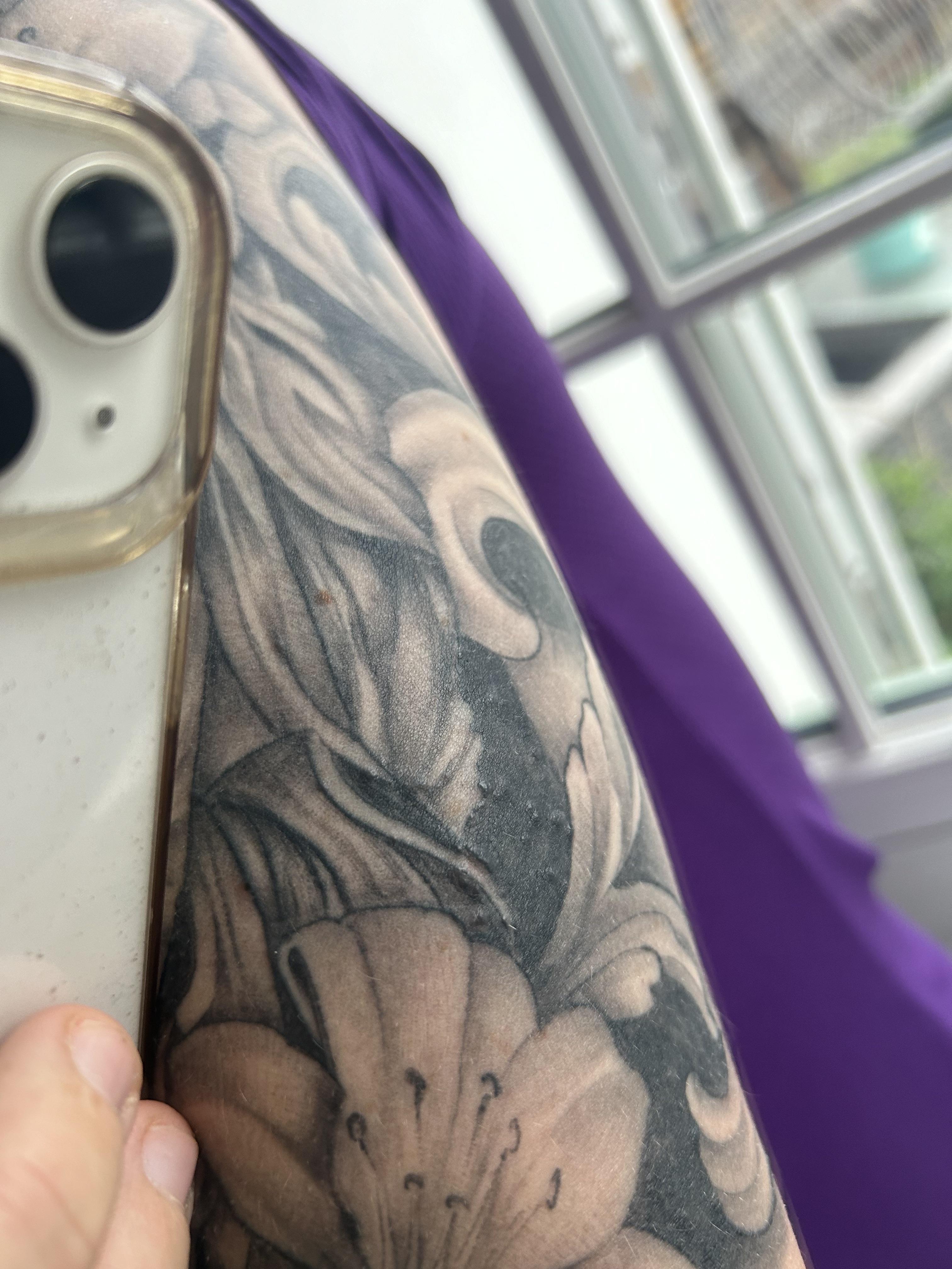 What are these bumps? | Scrolller