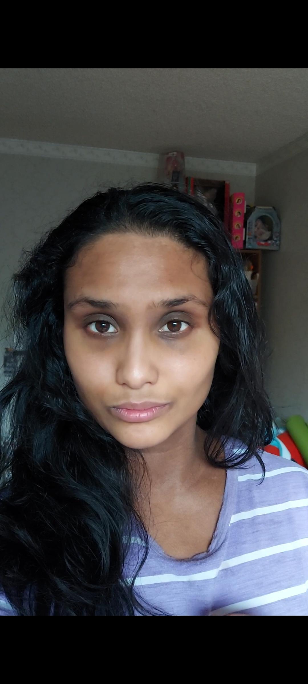 25f rate some of my worst skin condition photos | Scrolller