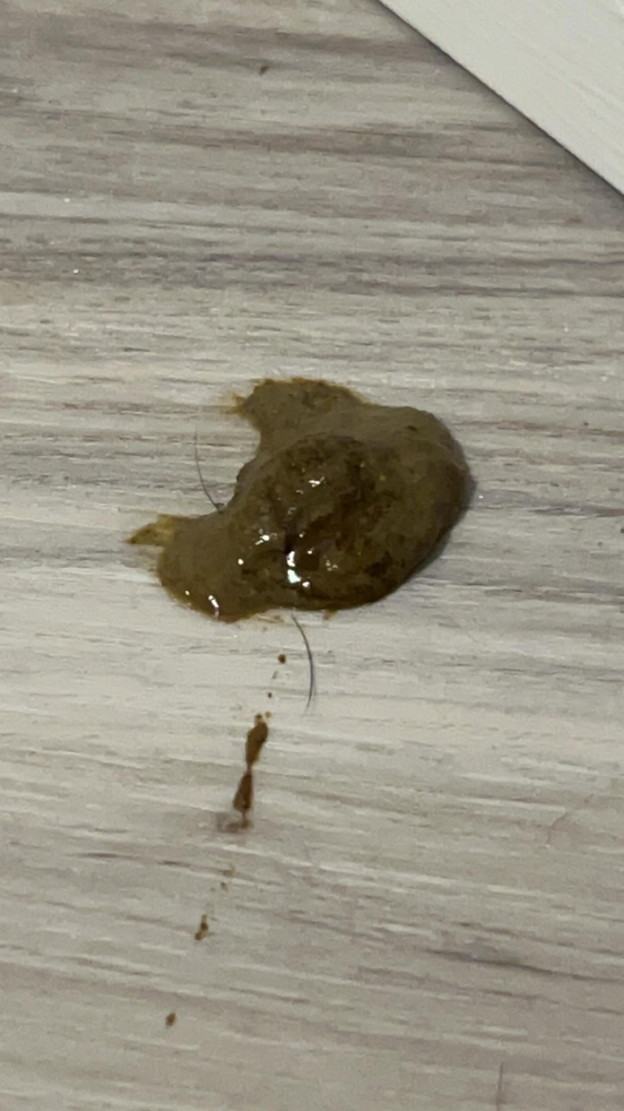 Is this bloody stool??? | Scrolller