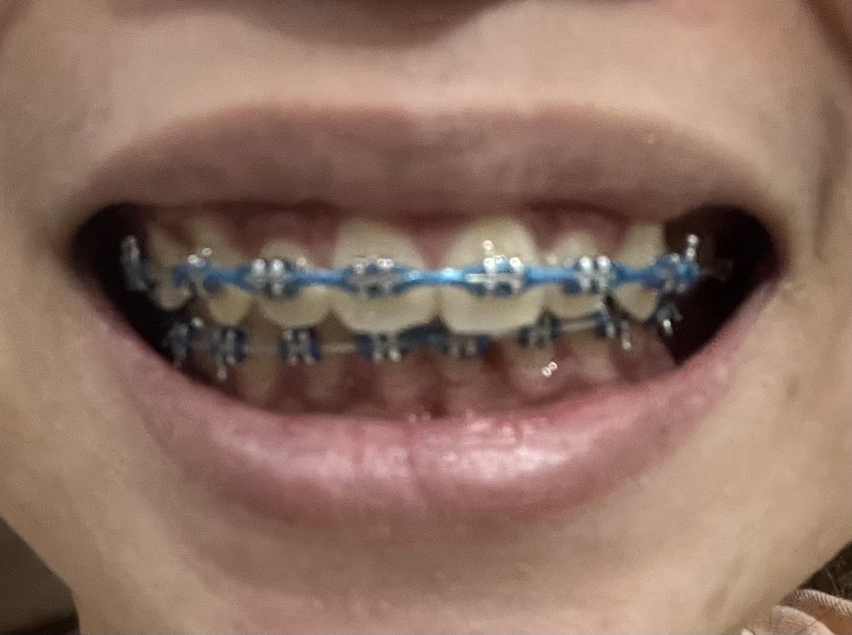 Does this looks normal? | Scrolller