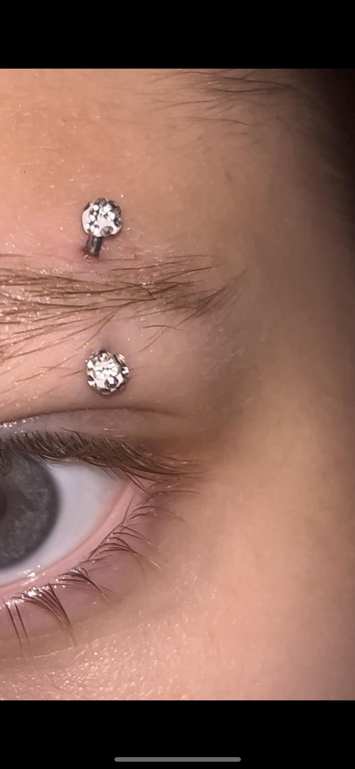 What’s that red bump:( | Scrolller