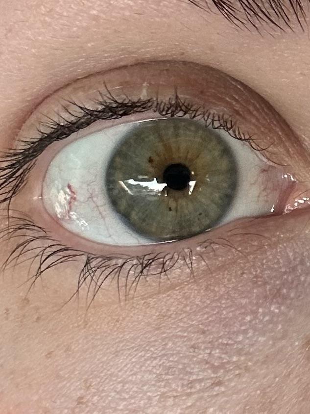 Green or hazel? Right eye looks more hazel than the left | Scrolller